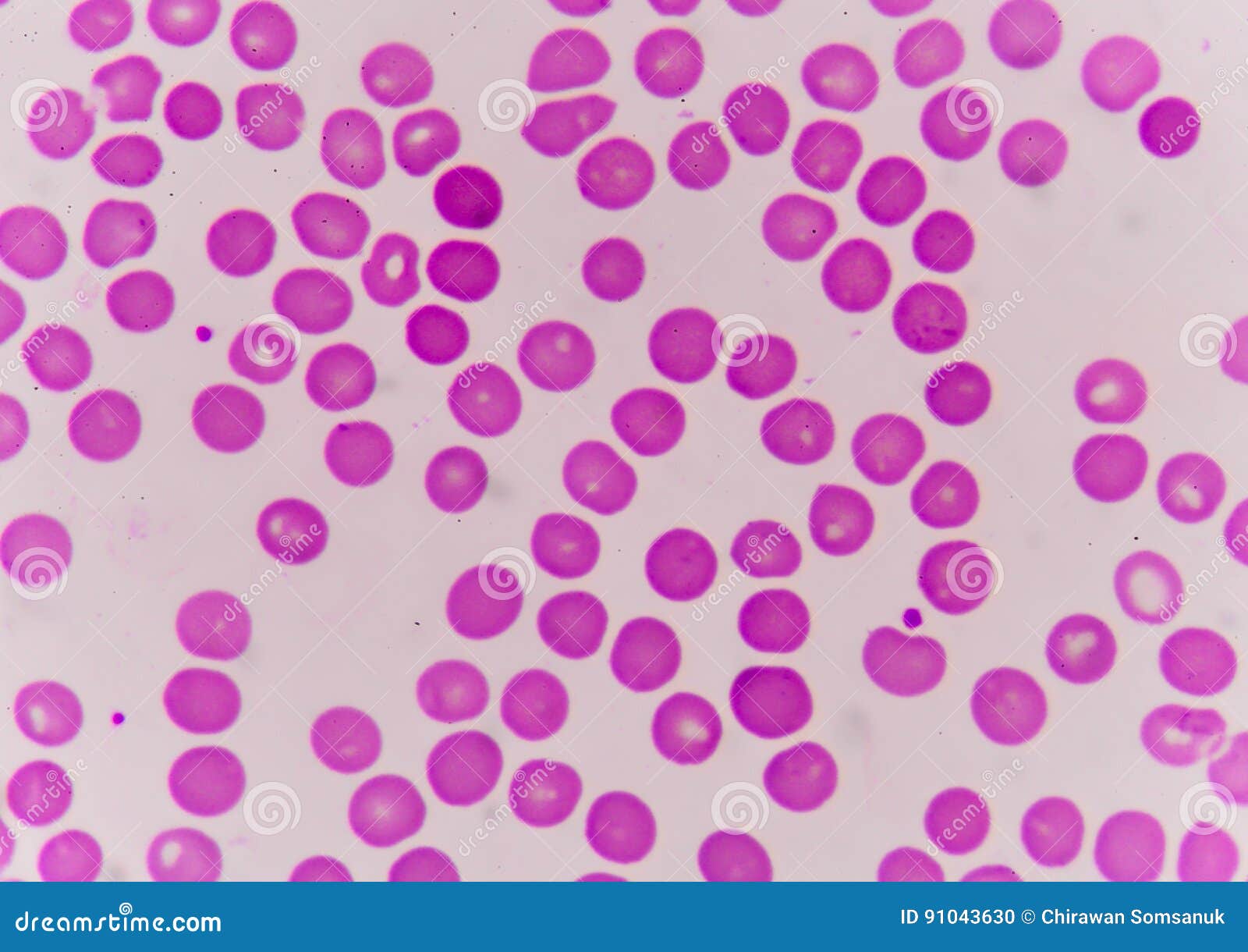 Normochromic Normacytic Red Blood Cells Stock Photo - Image of biology ...
