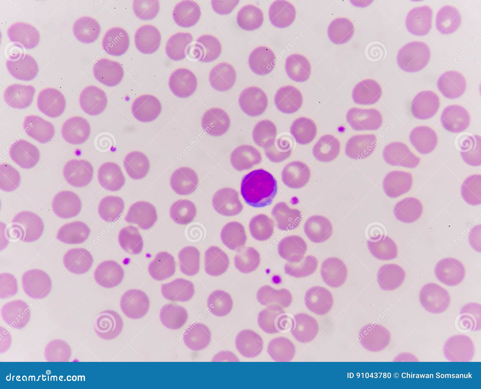 Normochromic Normacytic Red Blood Cells Stock Photo - Image of body ...