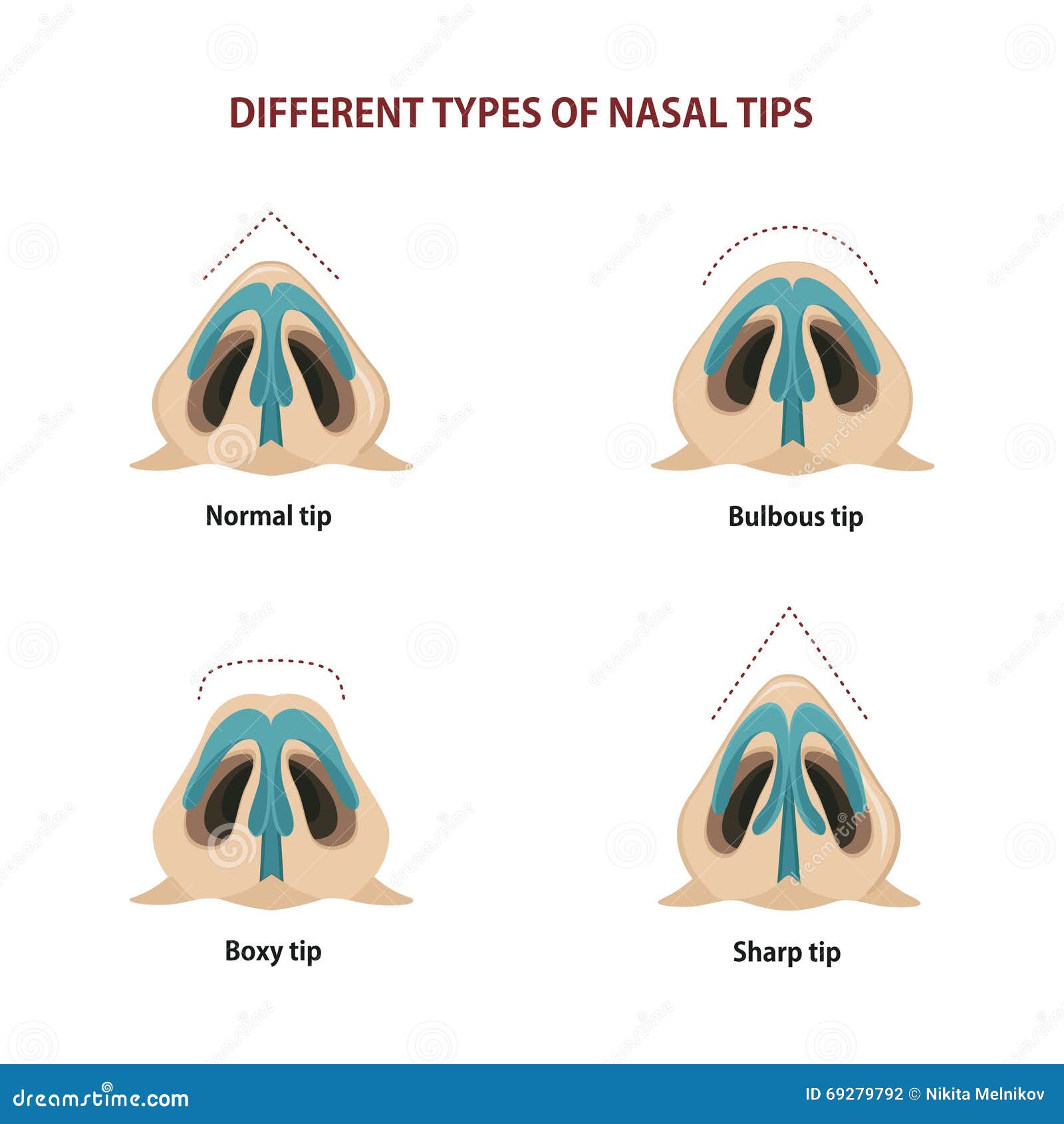 Nose stock vector. Illustration of medical, boxy, bulbous - 69279792