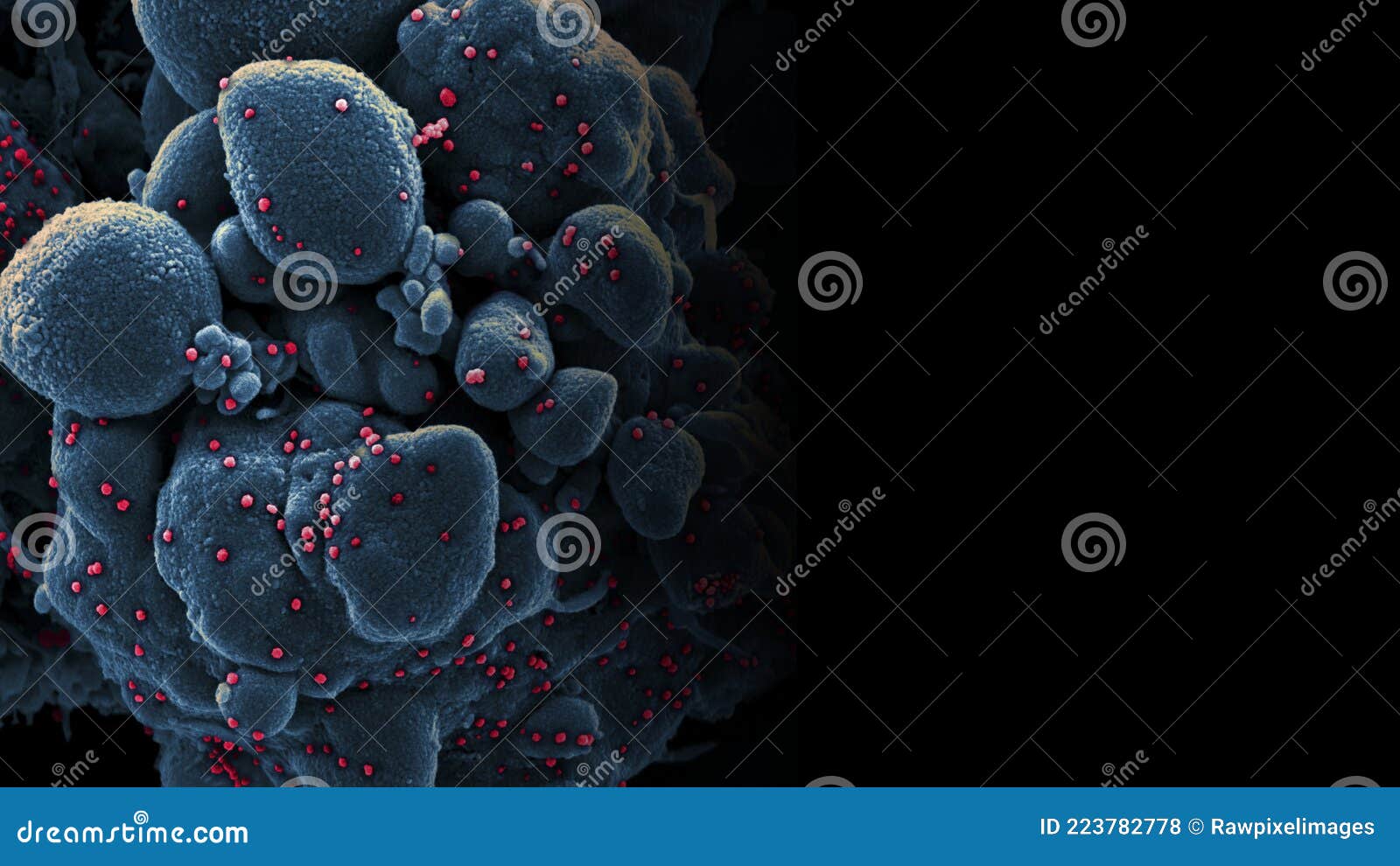 Coronavirus SARS-CoV-2. COVID-19. Virus, Pandemic Disease Explosion On ...