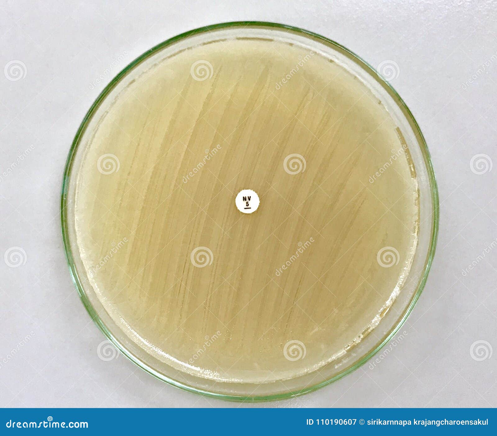 Novobiocin test stock image. Image of antimicrobial - 110190607