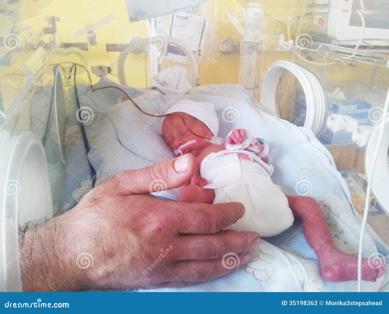 Nowonarodzony Dziecko W Inkubatorze Obraz Stock - Obraz złożonej z ...
