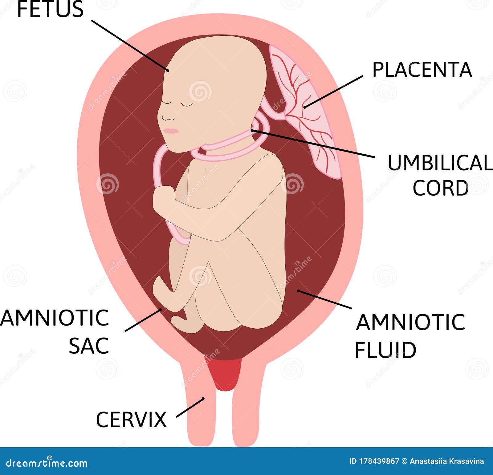 A Nuchal Cord The Umbilical Cord Is Wrapped Around The Fetus S Neck Stock Illustration