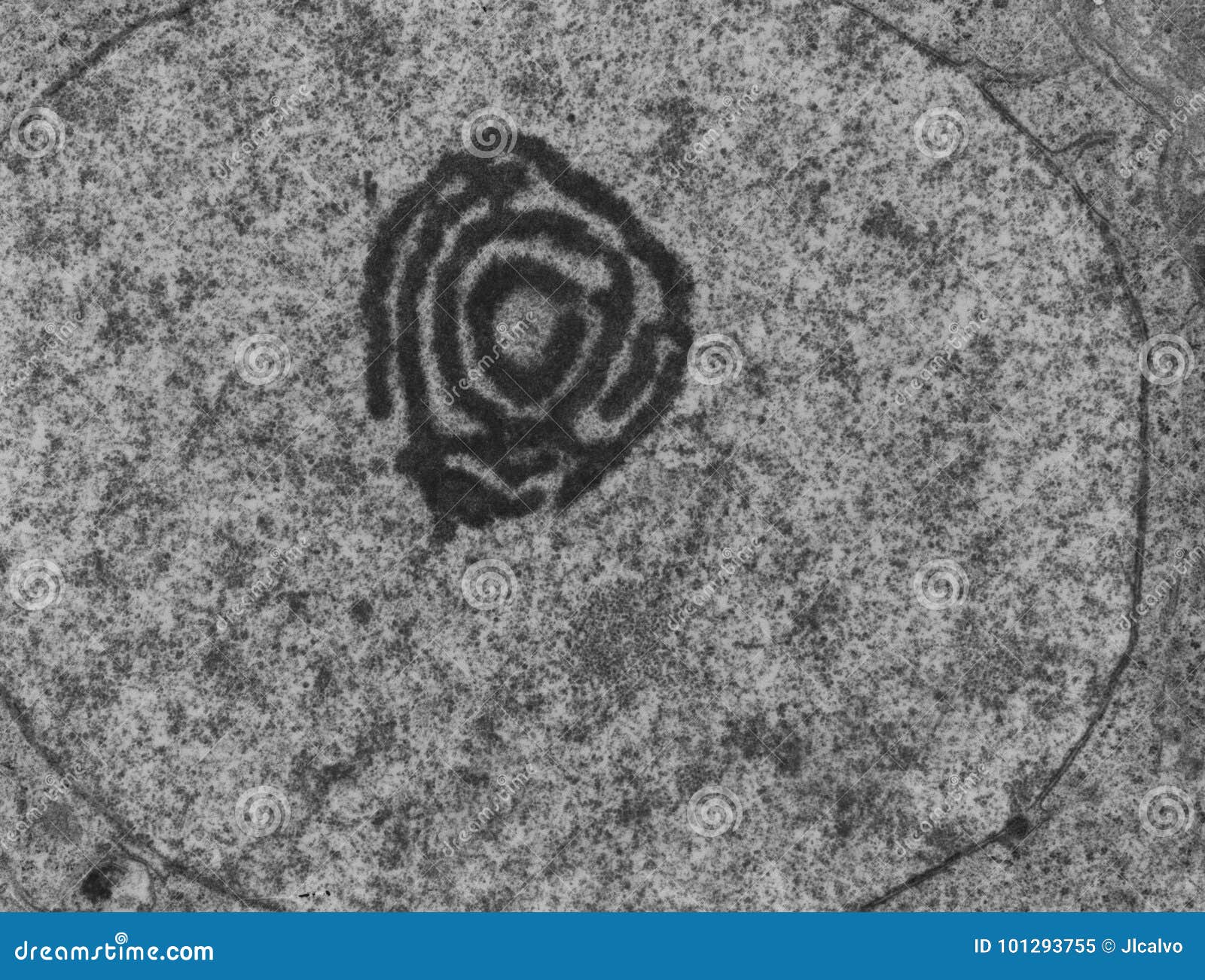 Nucleolus, TEM stock image. Image of cell, gamete, cytology - 101293755