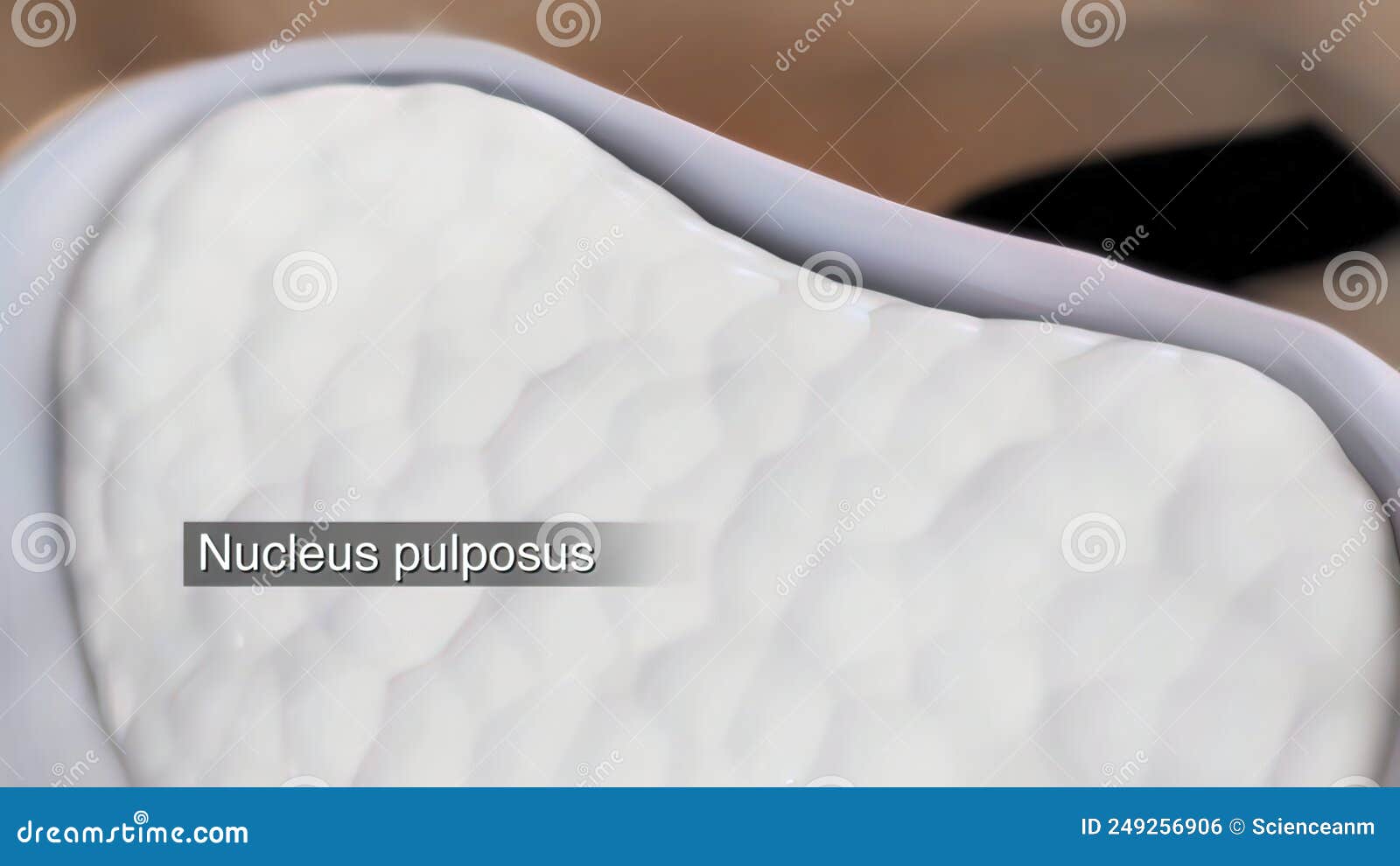 Nucleus Pulposus is the Inner Core of the Vertebral Disc Stock ...