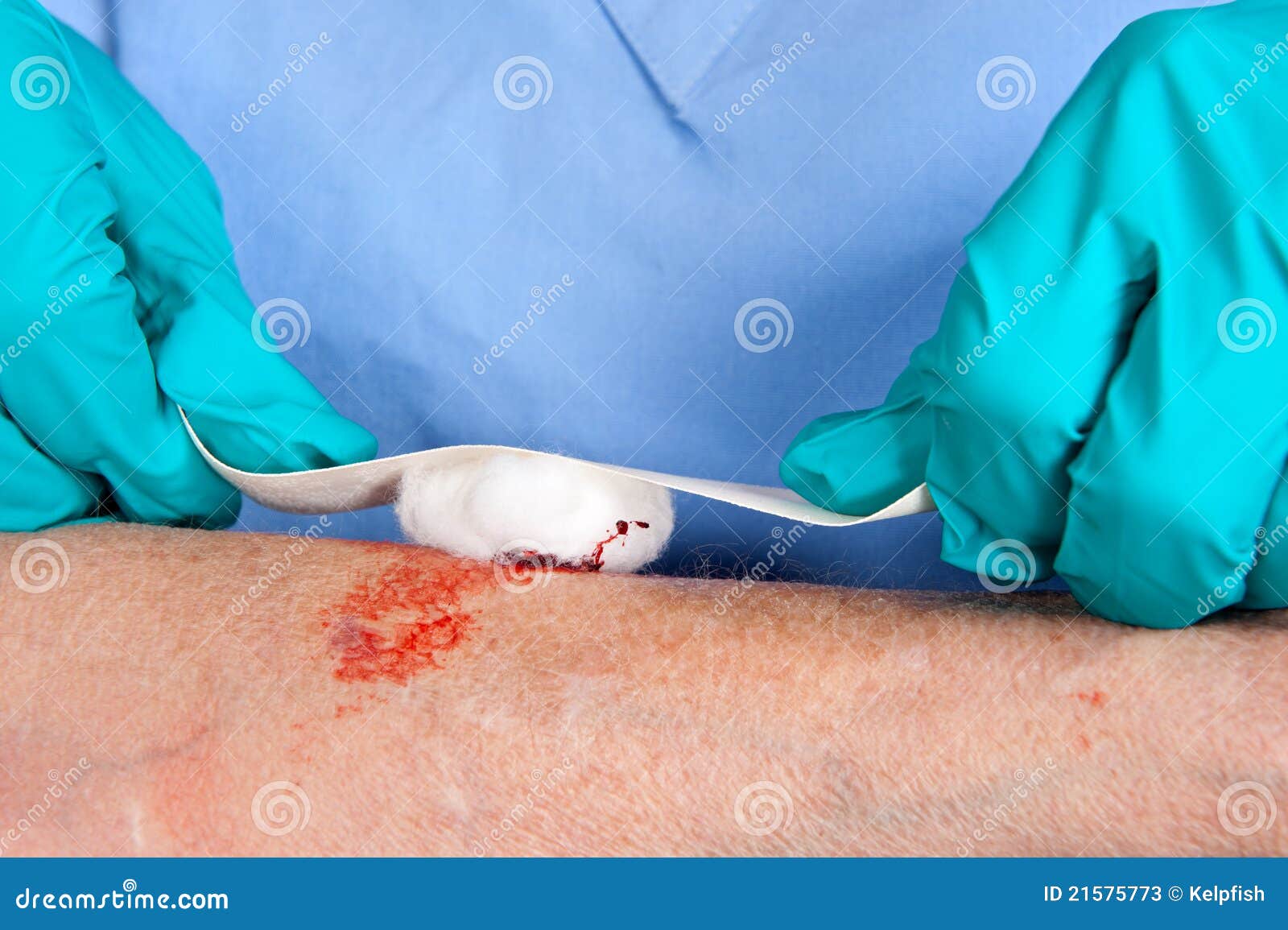 Nurse caring for wound stock image. Image of attending - 21575773