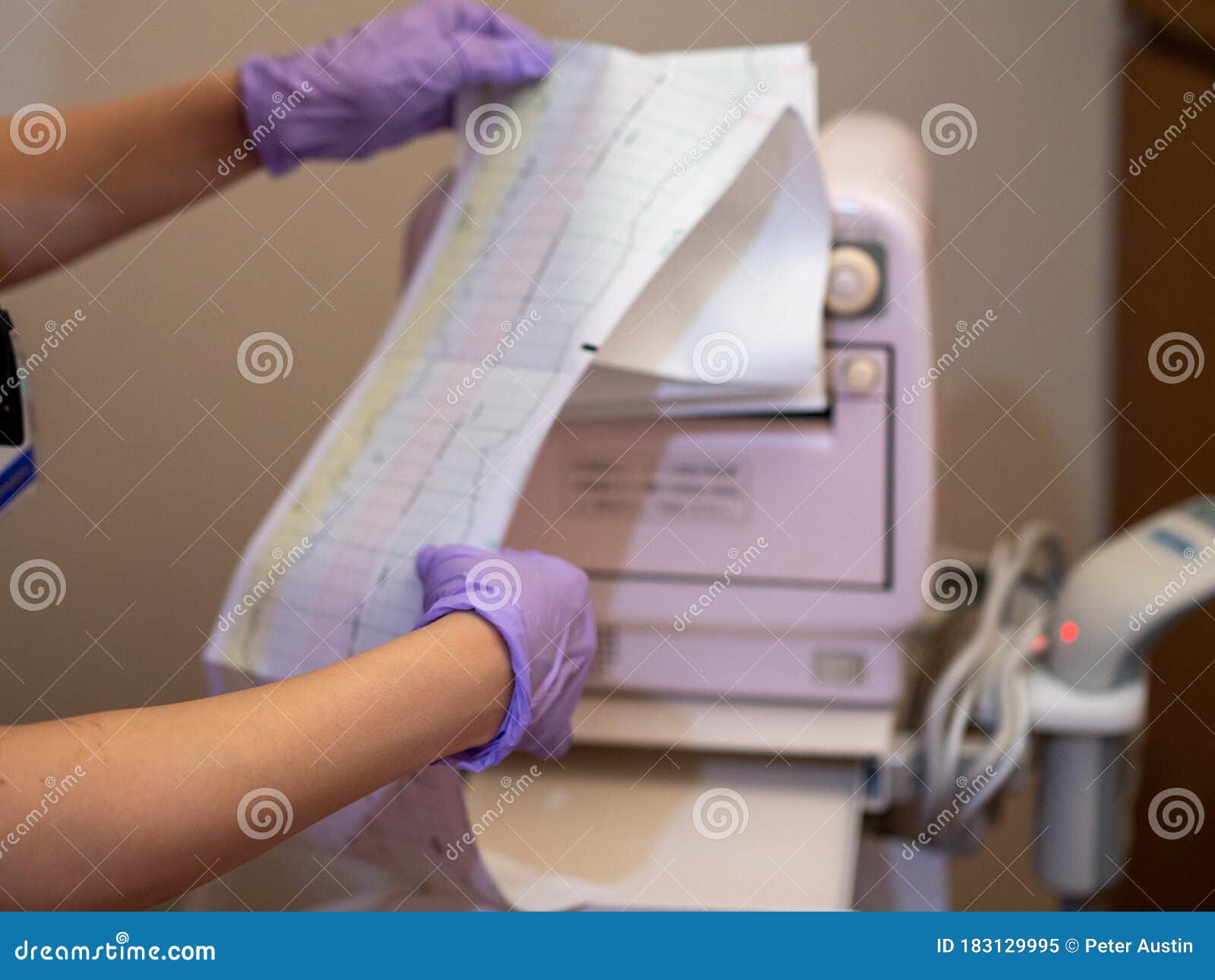 A Nurse Checking a Graph in a Hospital Stock Image - Image of nurse ...