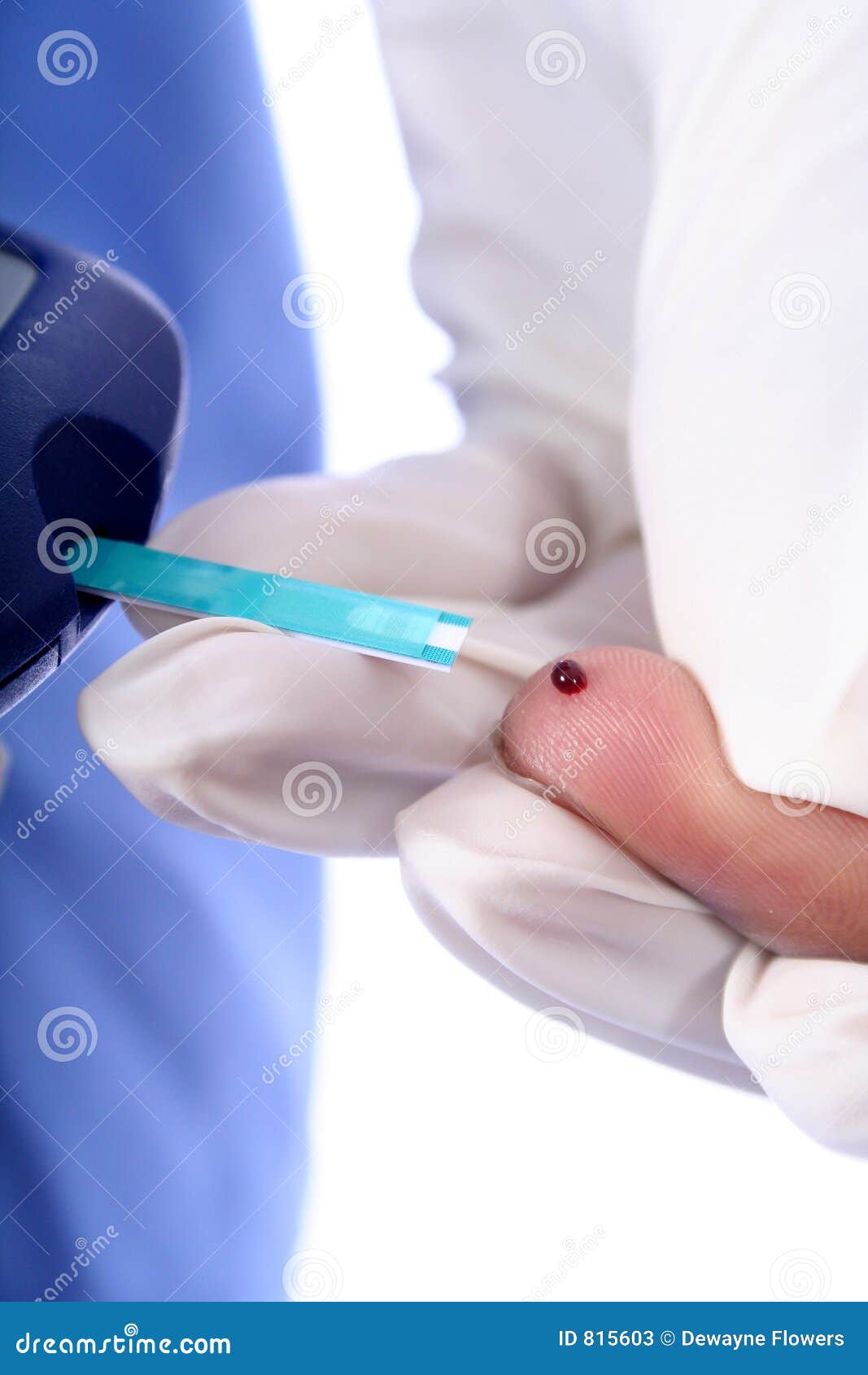 Nurse and a Diabetic Finger Stick Stock Image - Image of bloodpressure ...