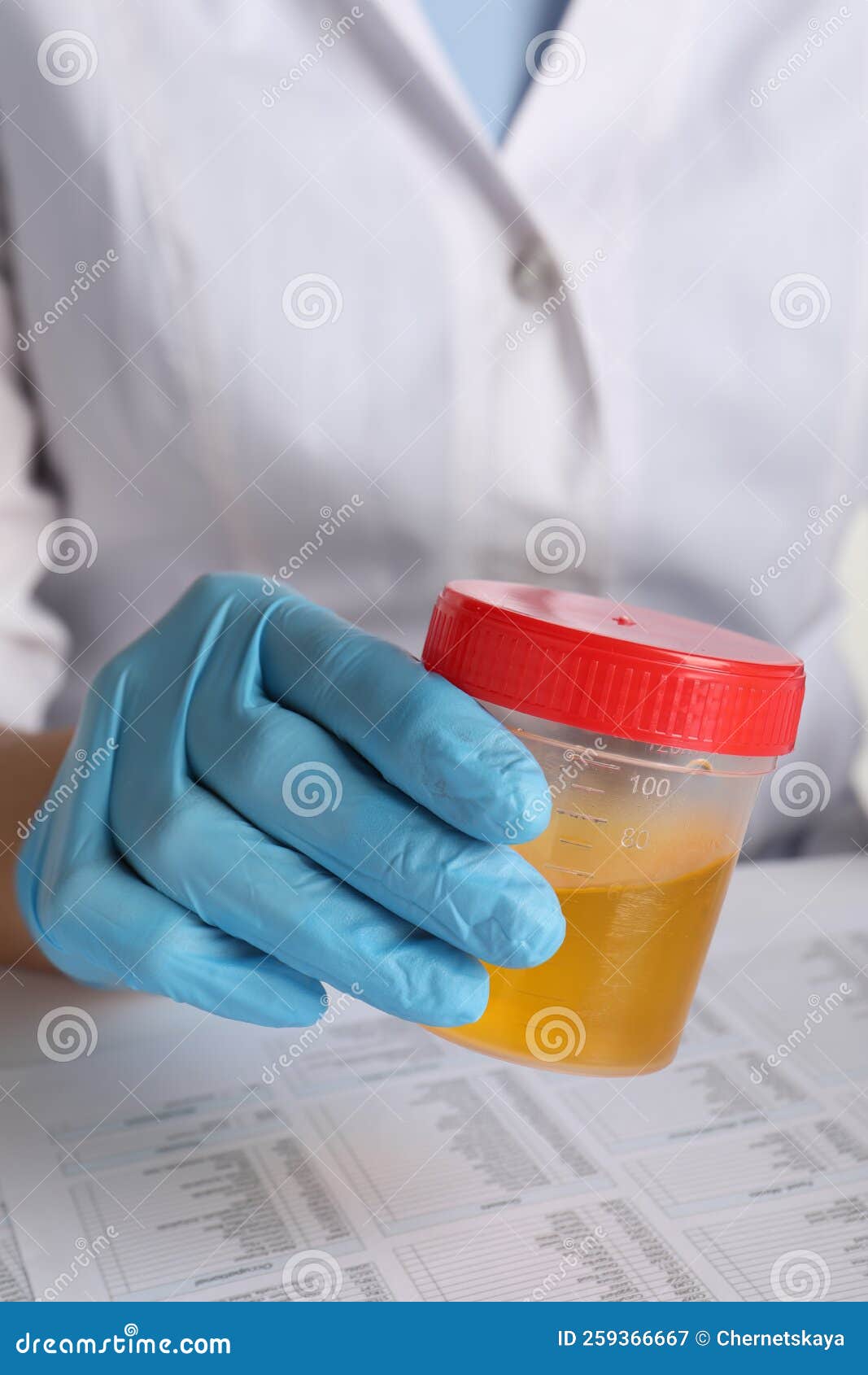 Nurse Holding Container with Urine Sample for Analysis at Table ...