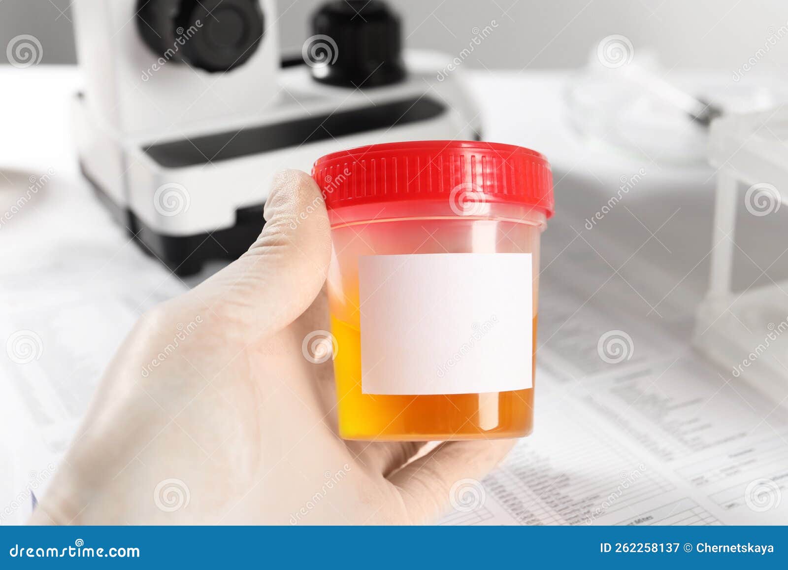 Nurse Holding Container with Urine Sample for Analysis at Table ...