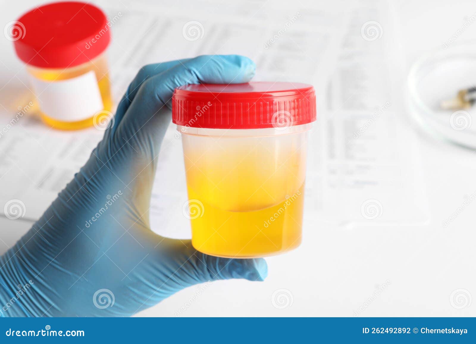 Nurse Holding Container with Urine Sample for Analysis at Table ...
