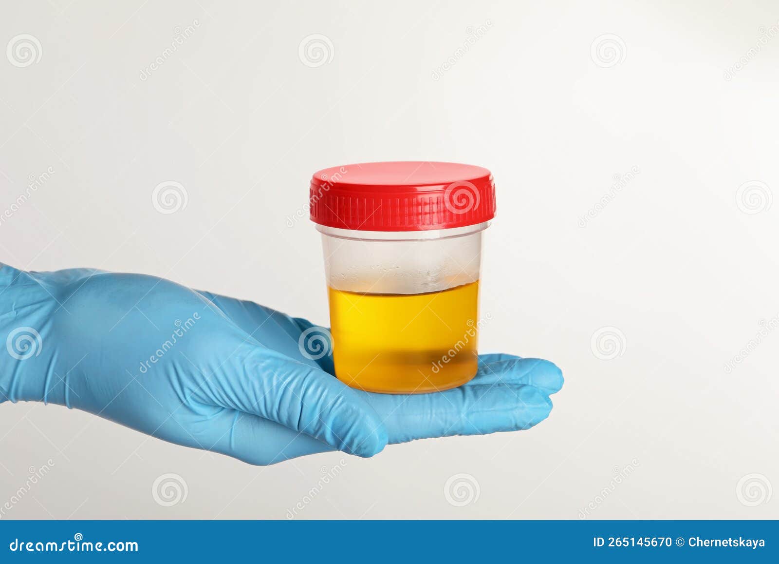 Nurse Holding Container with Urine Sample for Analysis on White ...