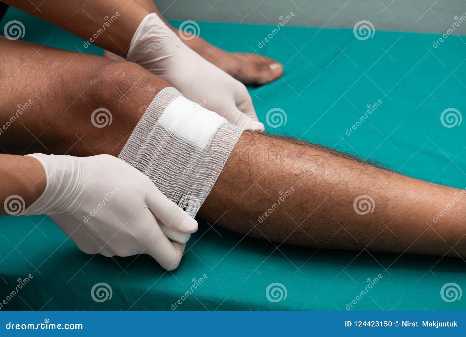 Nurses make leg ulcers stock photo. Image of bandaging - 124423150