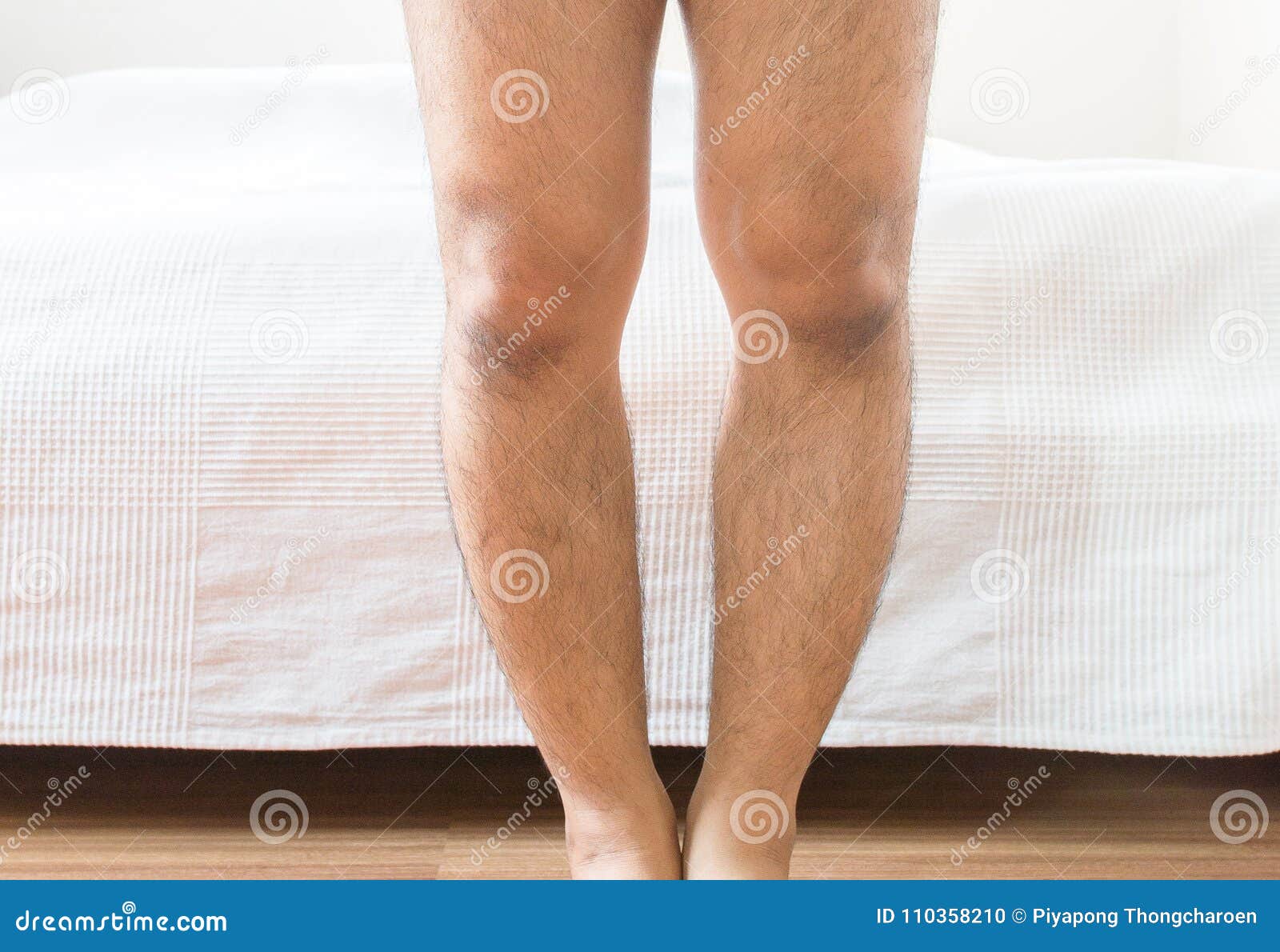 O-beinig Form Des Asiatischen Mannbeines Der Beine Stockfoto - Bild von ...