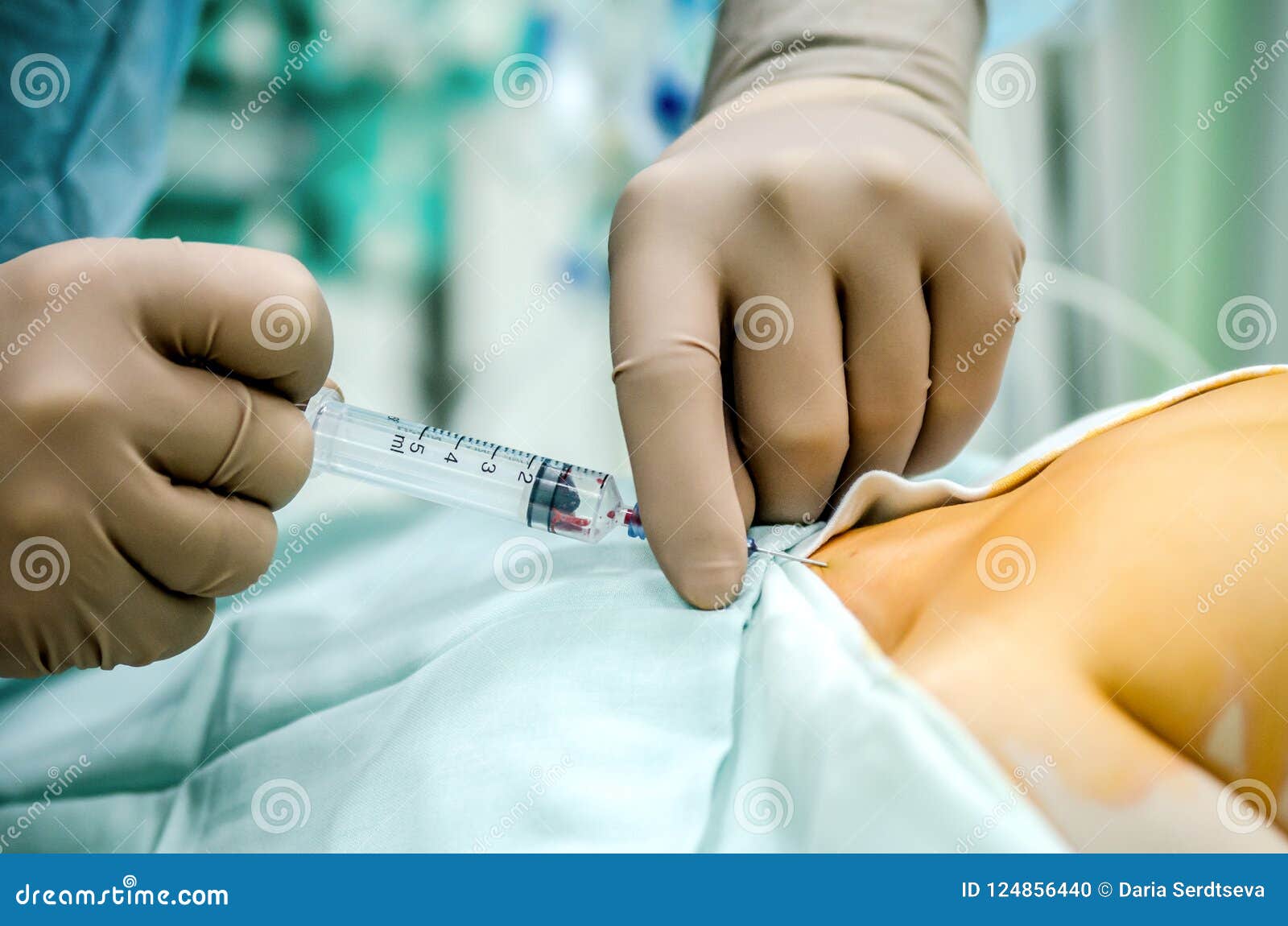 O Processo De Punctura a Veia Do Interna Dos Jugularis Foto de Stock ...