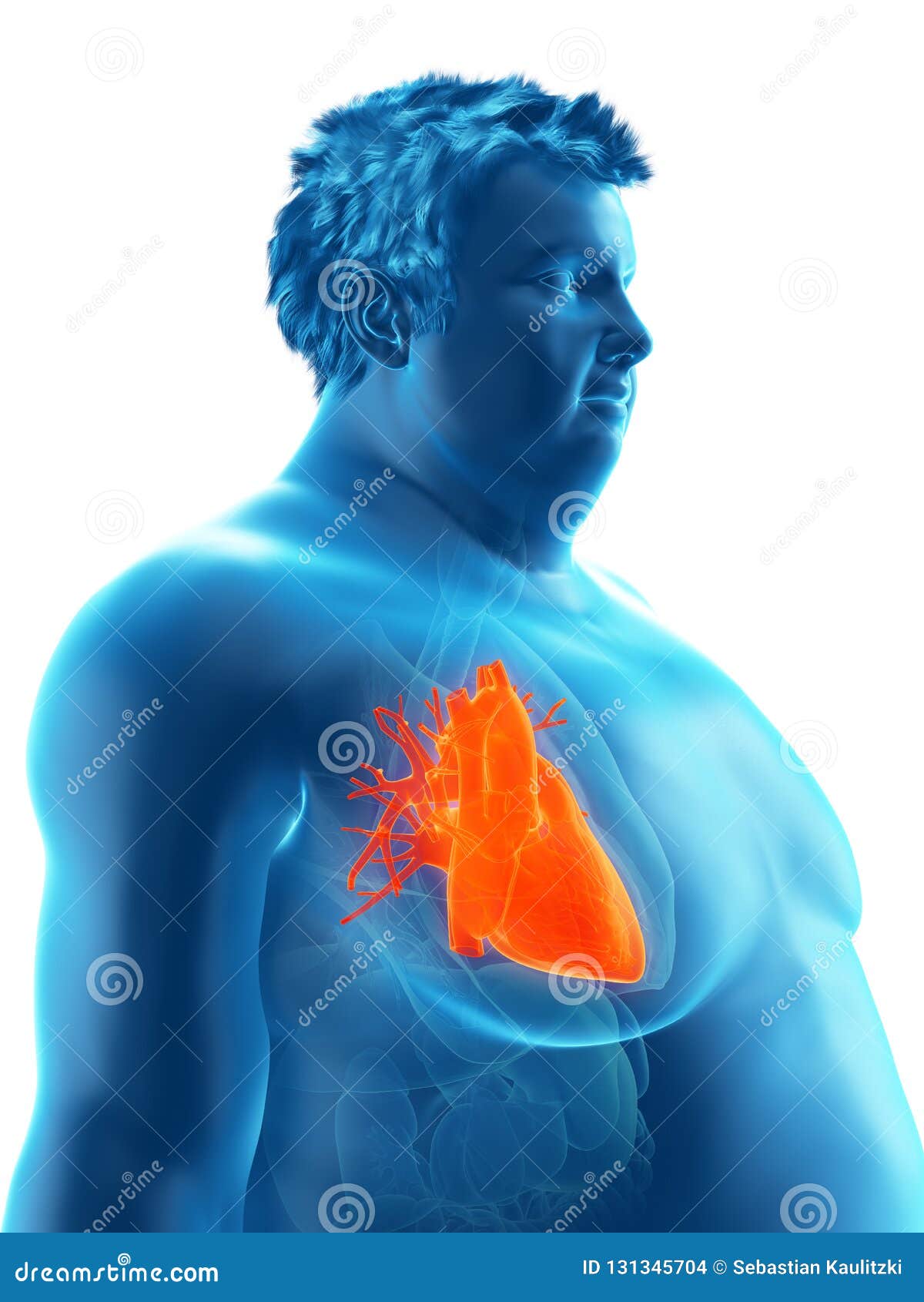 An obese mans heart stock illustration. Illustration of diet - 131345704