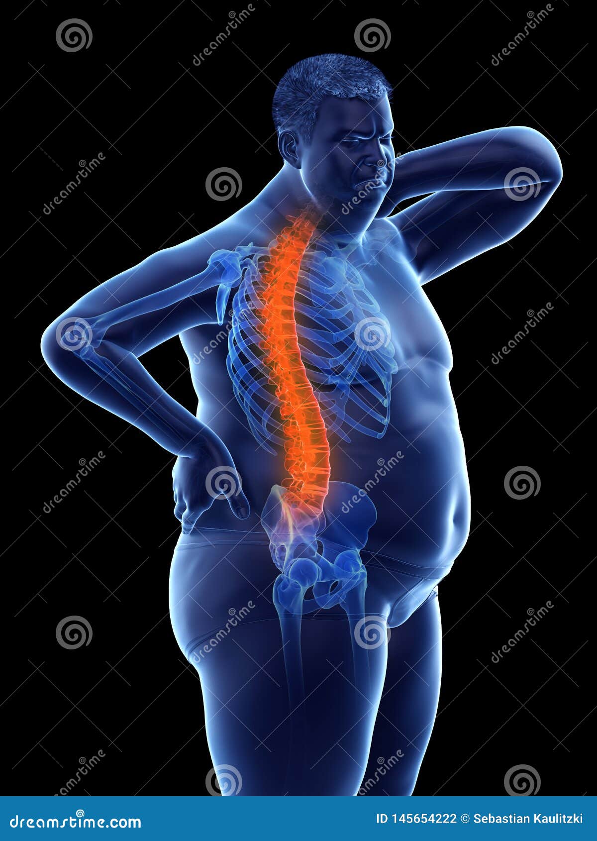 An obese mans painful back stock illustration. Illustration of body ...