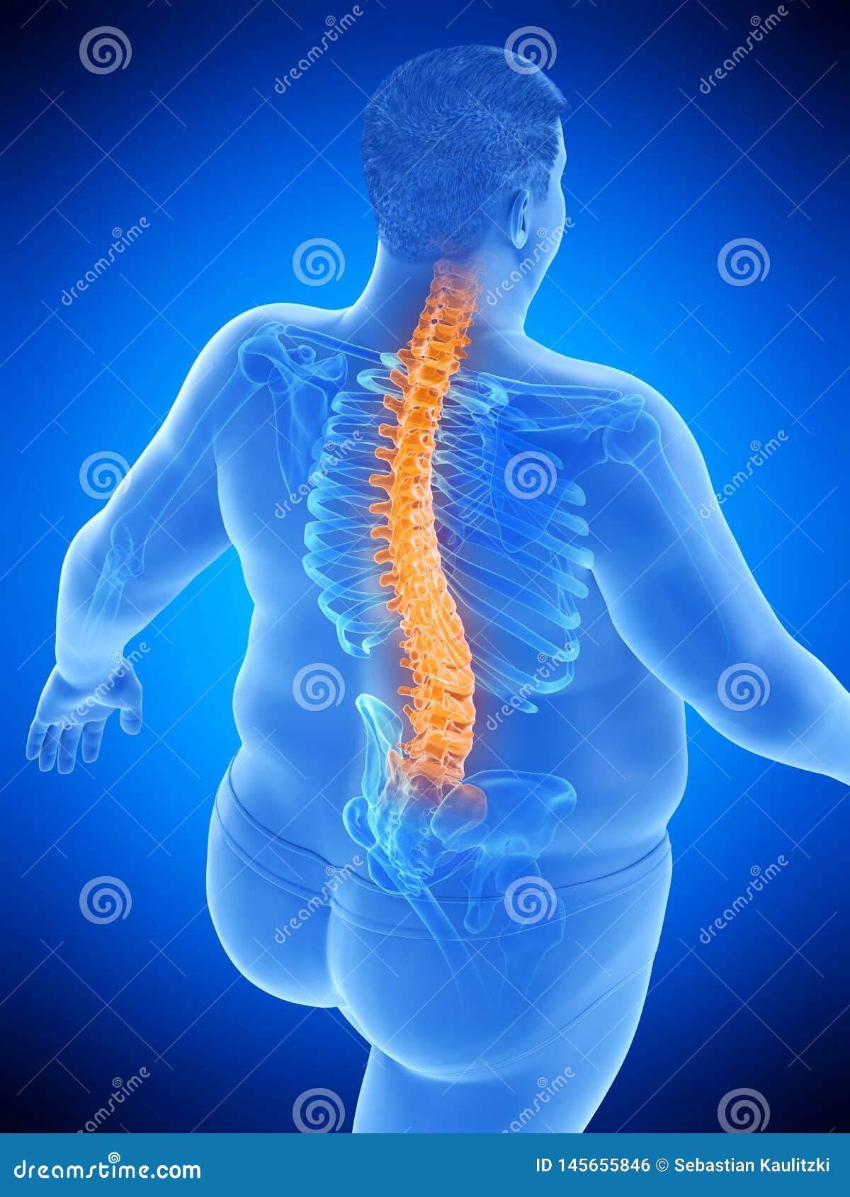 An obese mans painful back stock illustration. Illustration of human ...