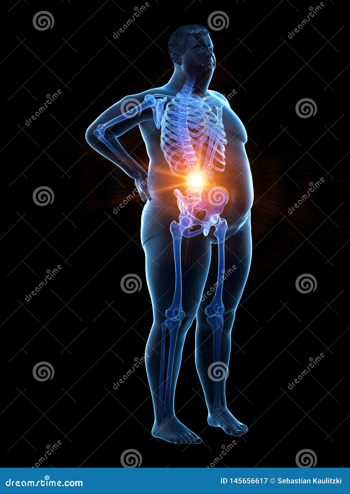 An obese mans painful back stock illustration. Illustration of anatomy ...