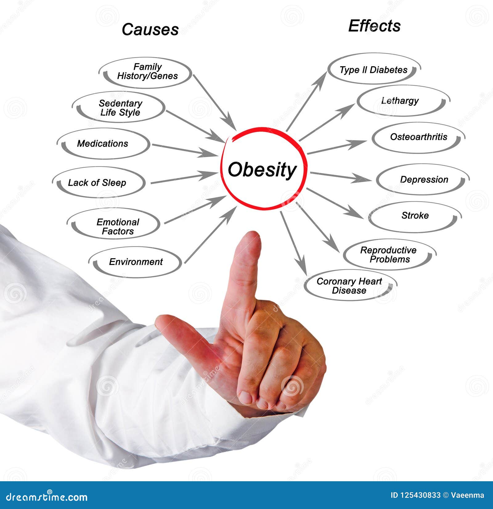 Obesity: Causes and Effects Stock Image - Image of healthcare, disease ... Obesity: Causes and Effects Stock Image - Image of healthcare, disease ...