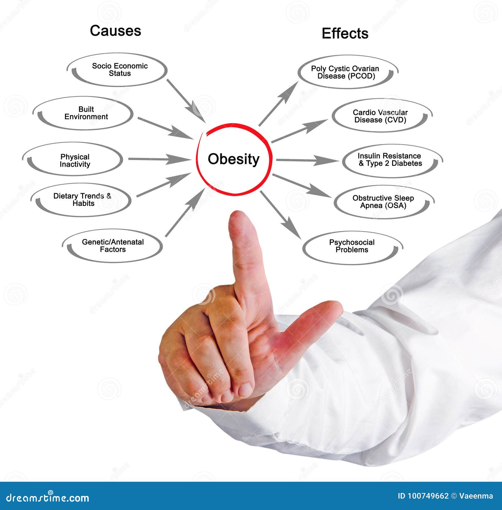 Obesity: Causes and Effects Stock Photo - Image of diagram, built ...