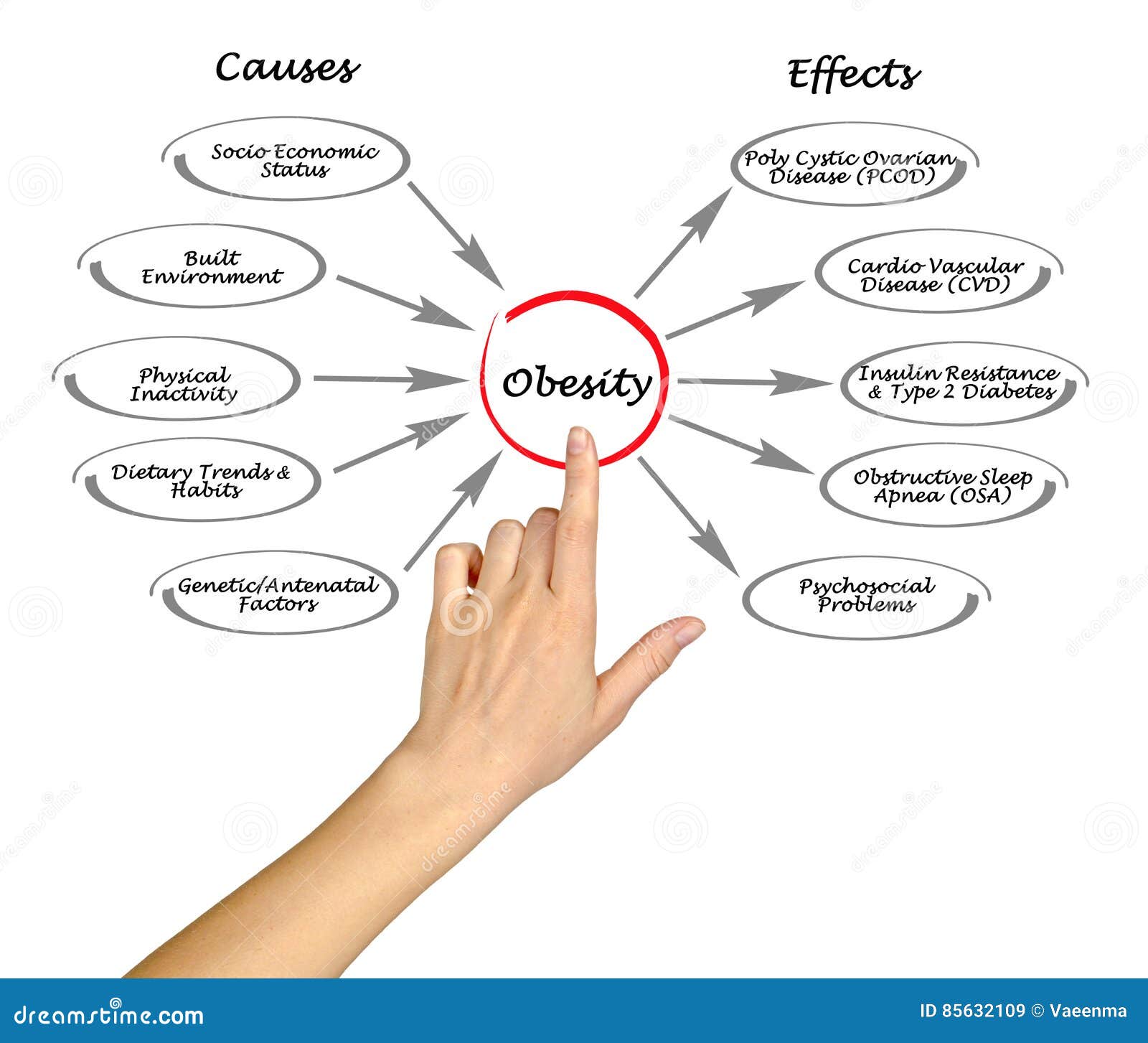 Obesity: Causes and Effects Stock Image - Image of lecturer, diabetes ...