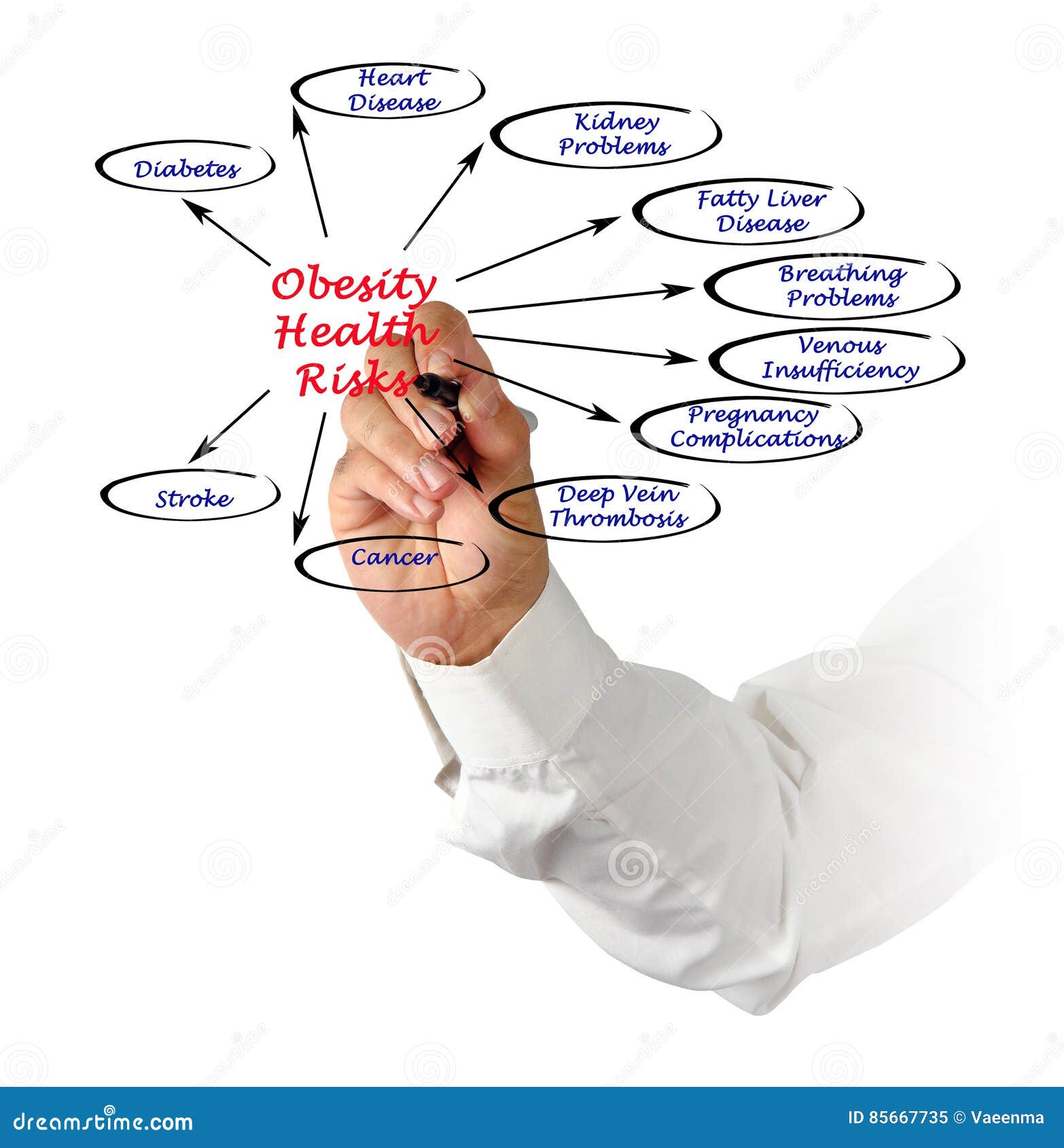 Obesity Health Risks stock image. Image of gall, health - 85667735