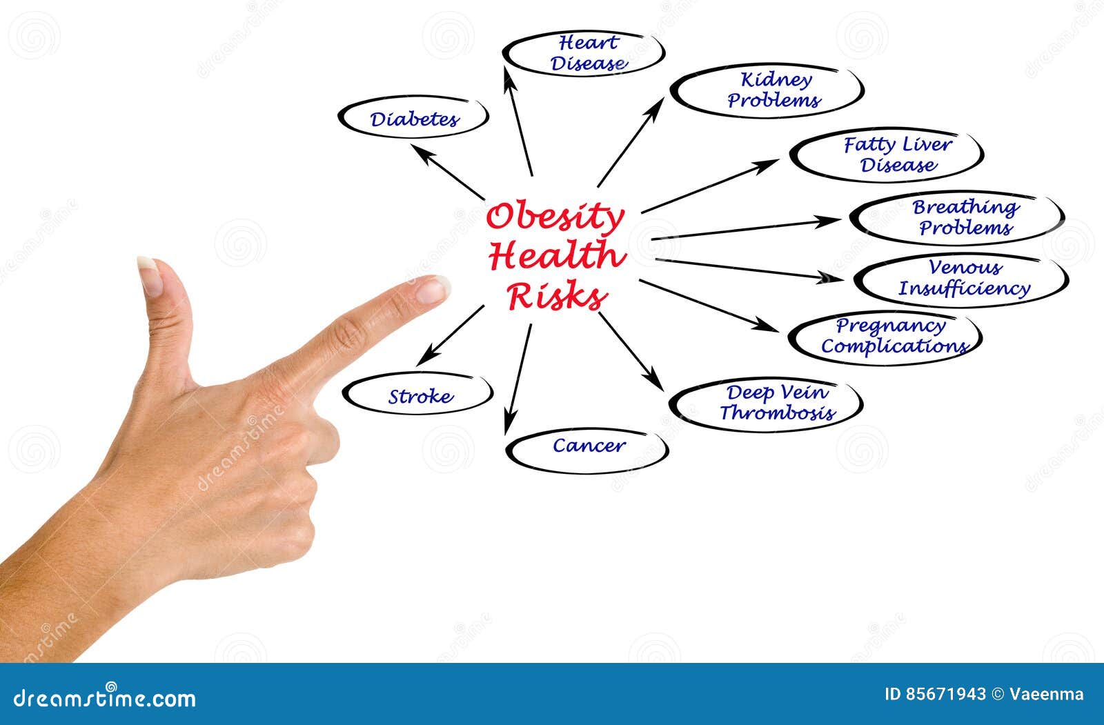 Obesity Health Risks stock image. Image of pregnancy - 85671943