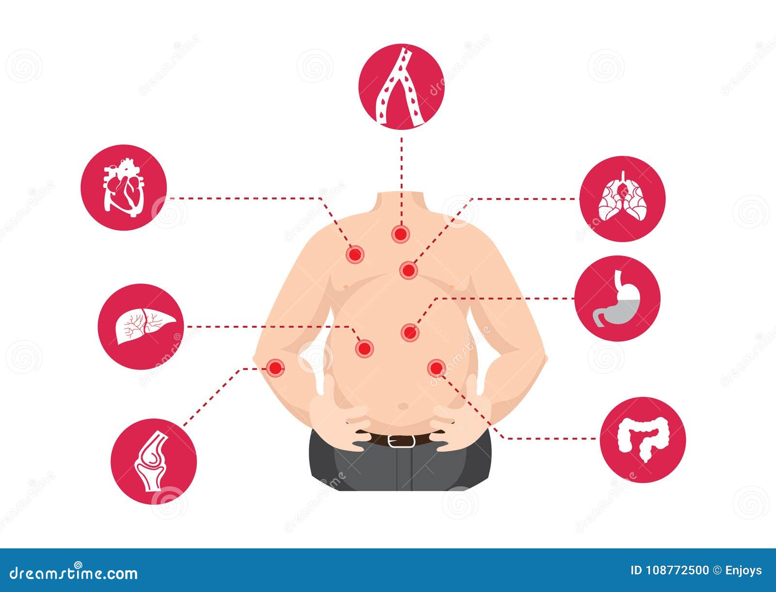 Obesity related diseases stock vector. Illustration of health - 108772500