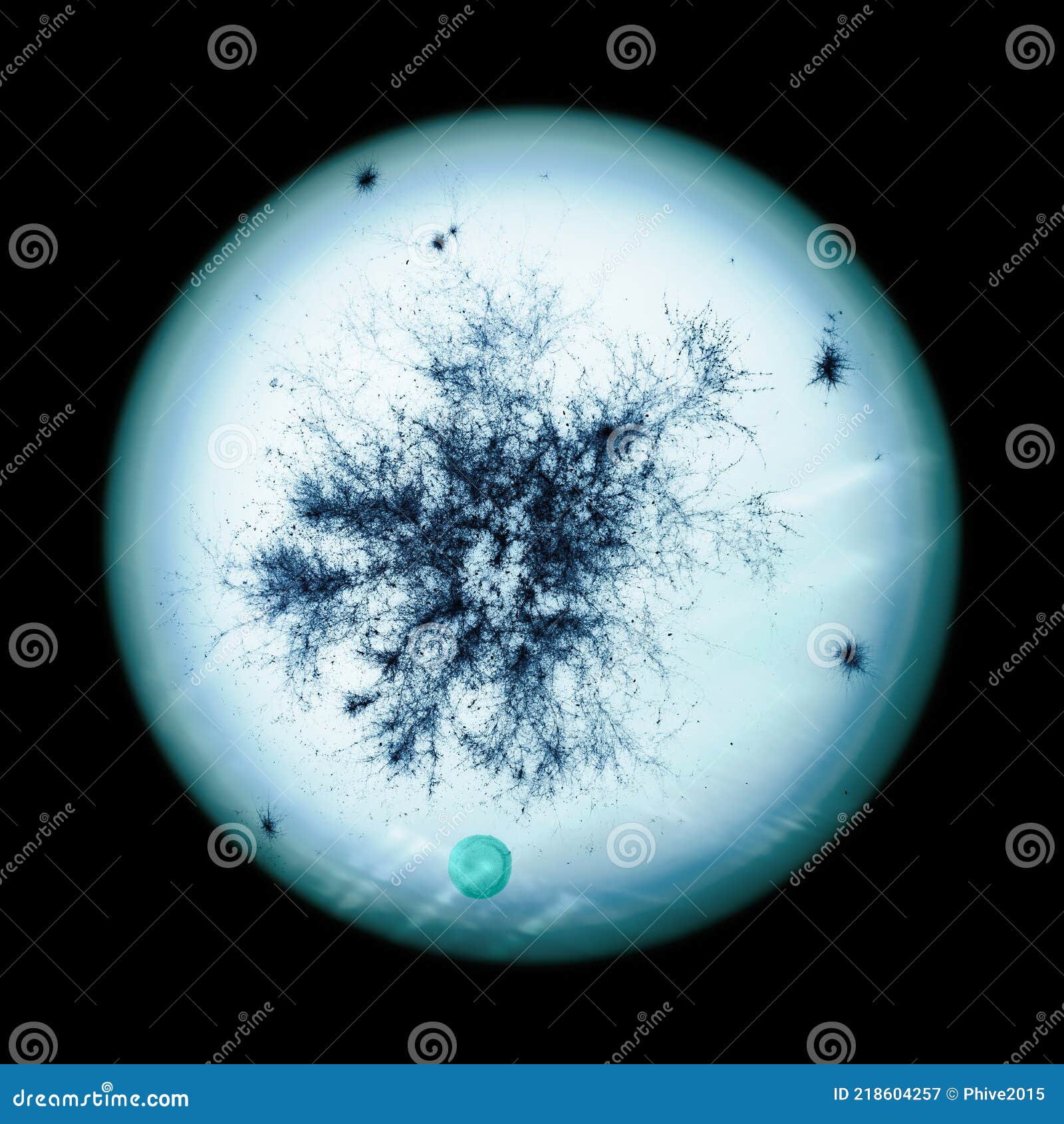 Microscope Of Black Fungus Spore Strain With Lactophenol Cotton Blue ...