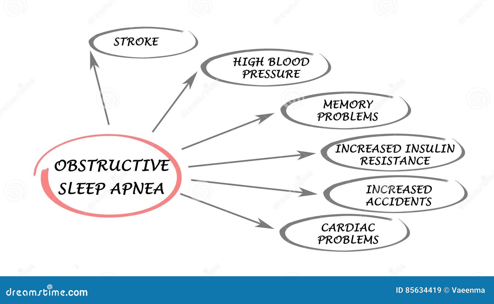 Obstructive Sleep Apnea stock illustration. Illustration of care - 85634419