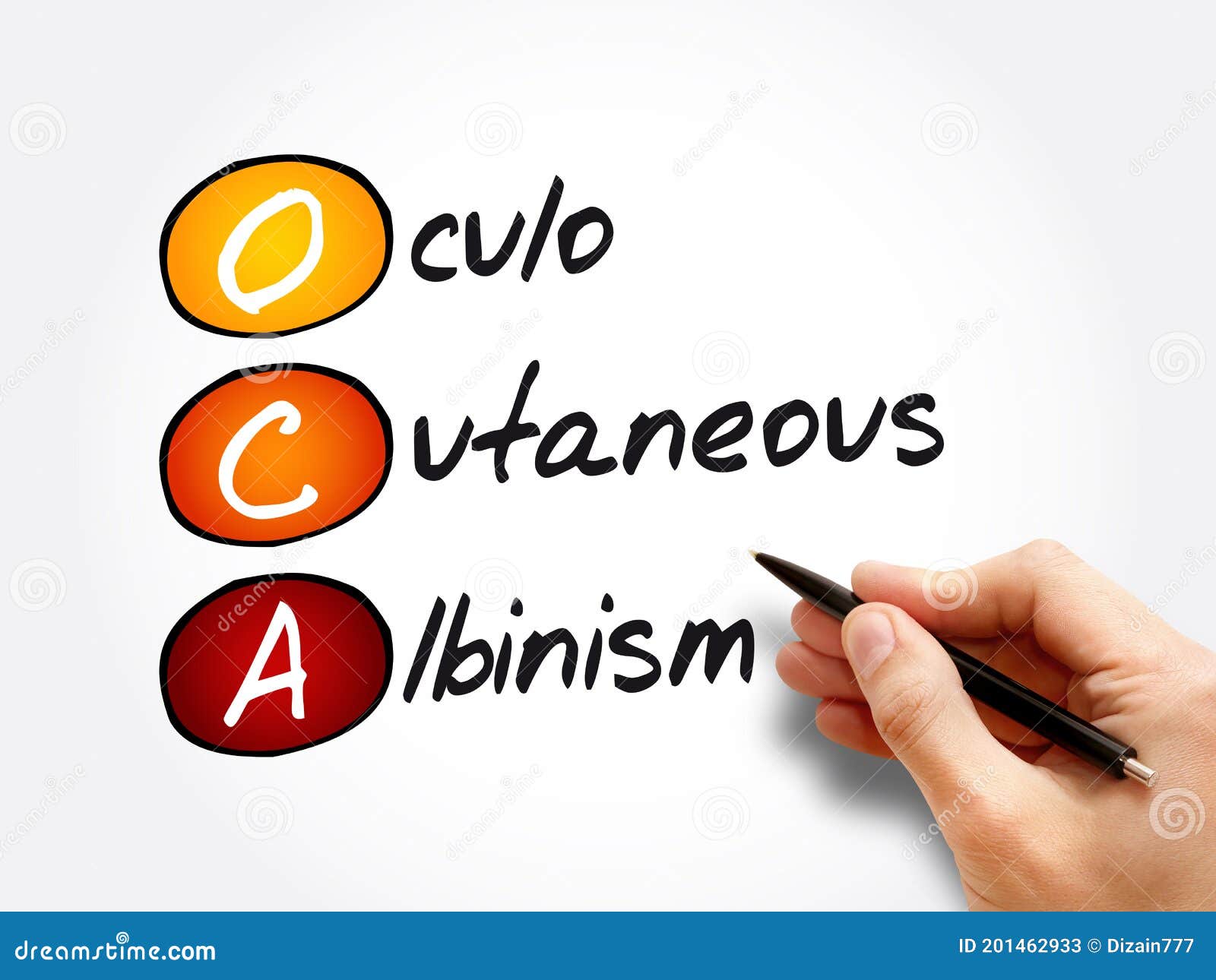 OCA - Oculo Cutaneous Albinism Acronym, Concept On Blackboard Stock ...