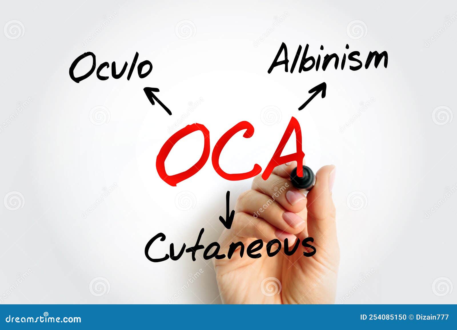 OCA - Oculo Cutaneous Albinism Acronym, Concept Background Stock Photo ...