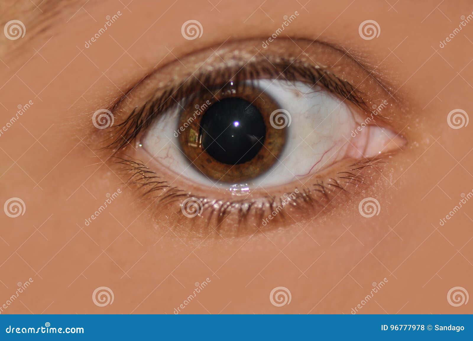 Occhio Con La Pupilla Dilatata Fotografia Stock - Immagine di chiusura ...