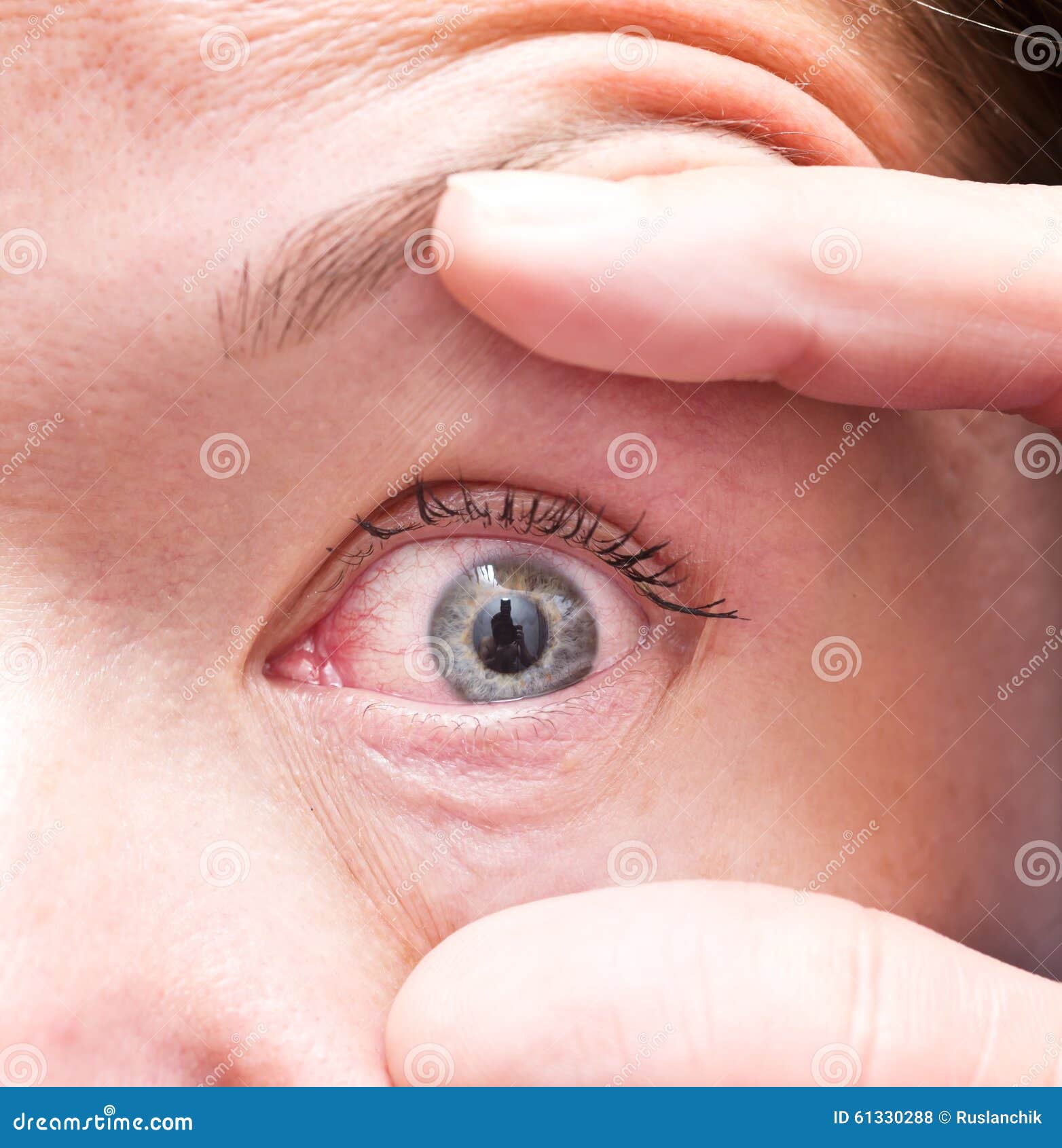 Occhio irritato fotografia stock. Immagine di eyeball - 61330288