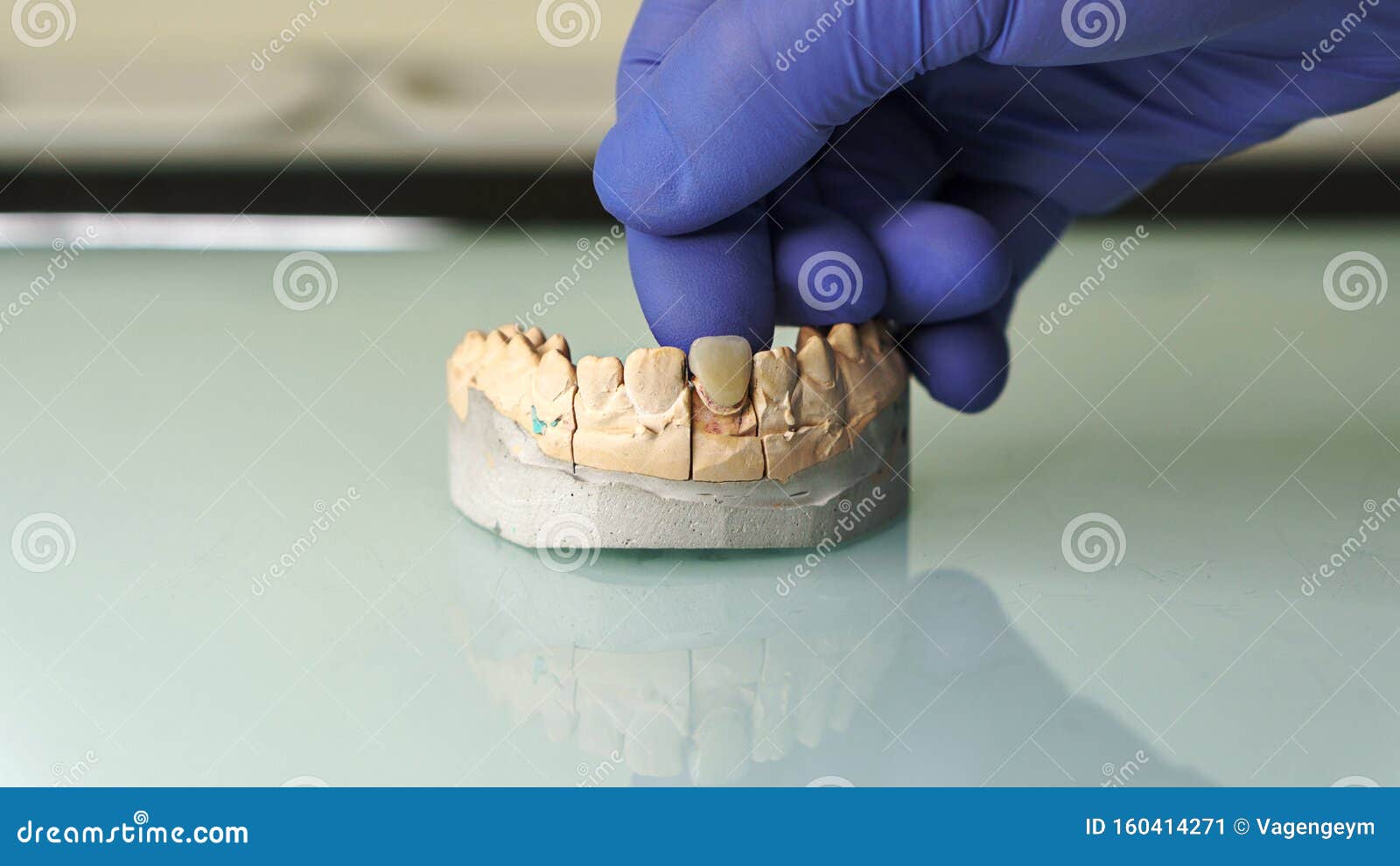 Odontolog?a dental imagen de archivo. Imagen de dentadura - 160414271