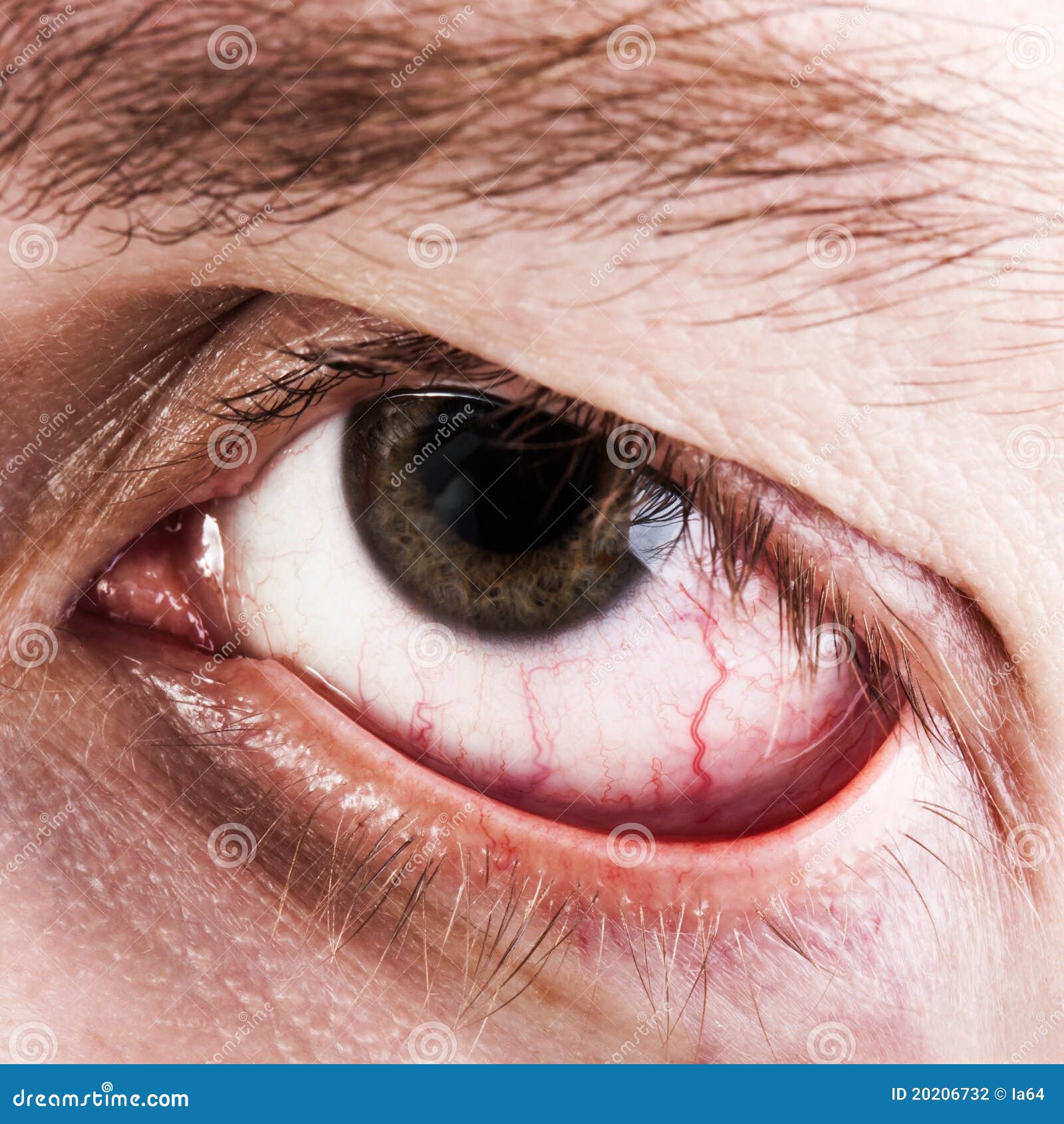 Oeil Humain Capillaire De Sang Photo stock - Image du personne ...