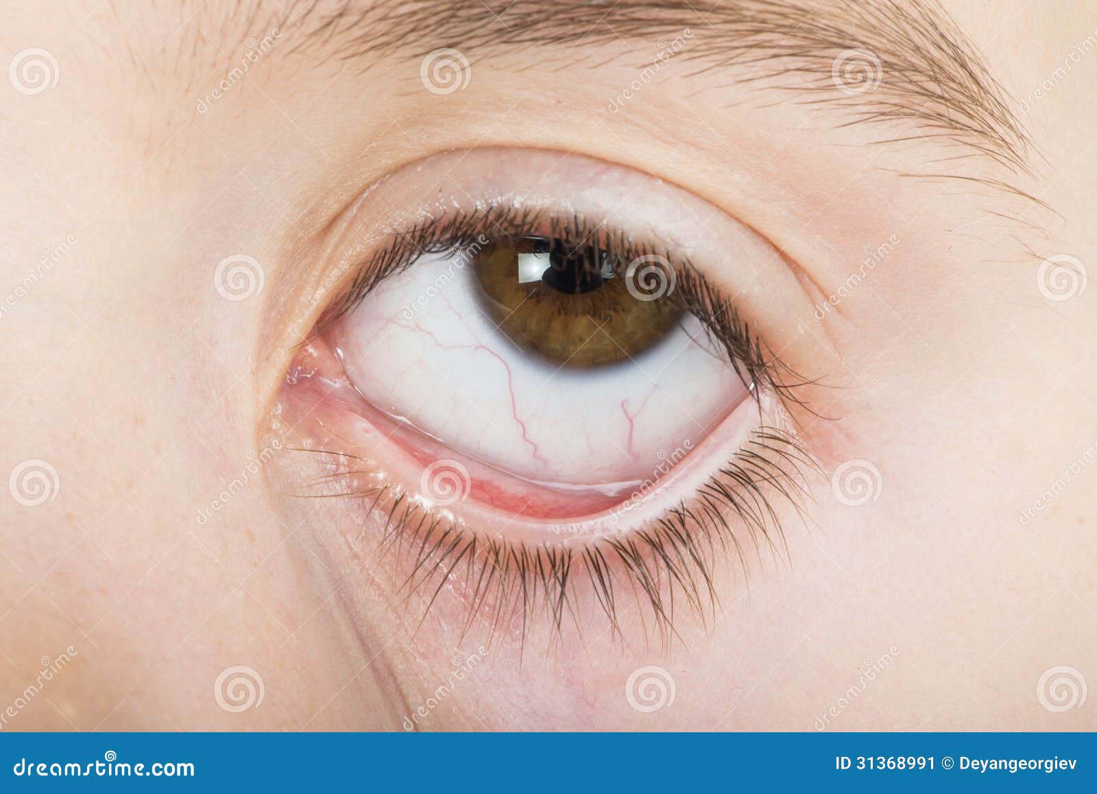 Oeil humain grand ouvert image stock. Image du fermer - 31368991