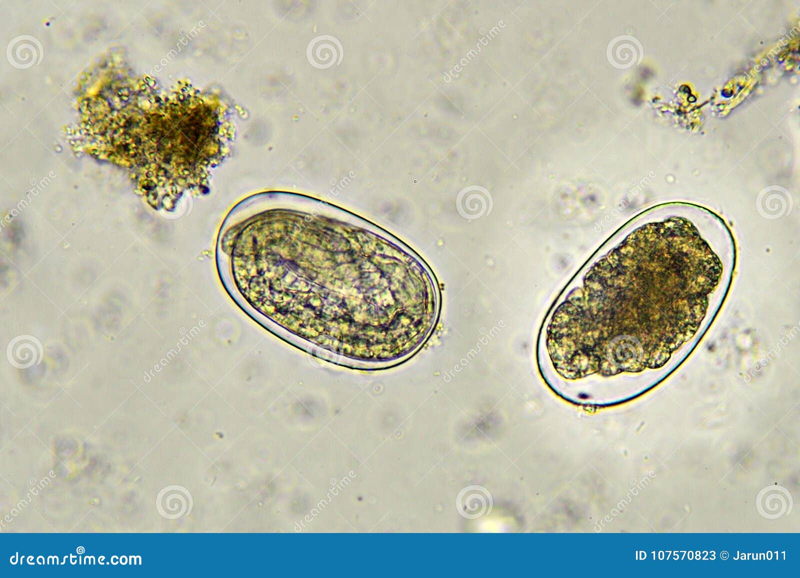 Oeufs D'ankylostome Dans Les Selles Image stock - Image du oeuf, micro ...