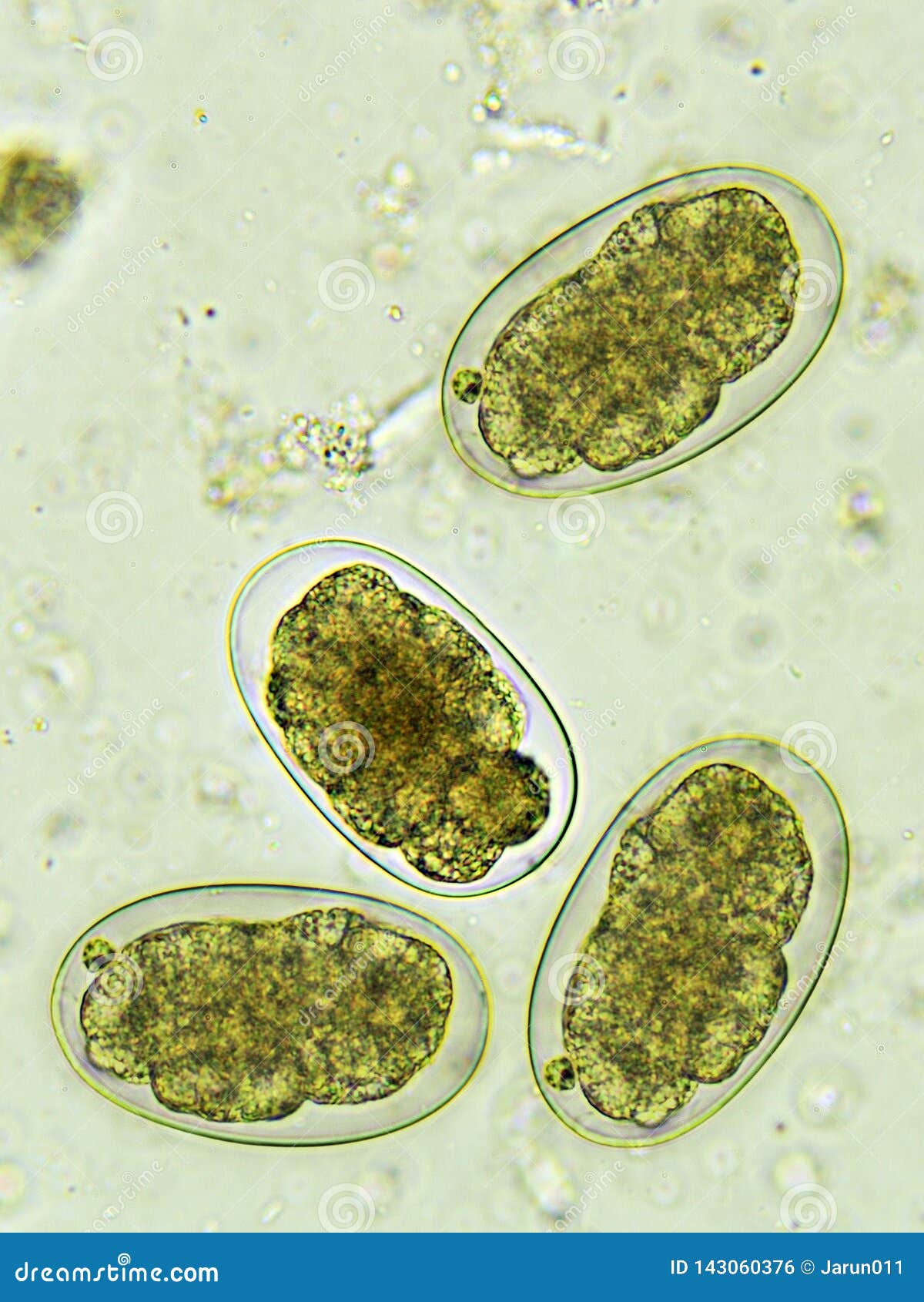 Oeufs D'ankylostome Dans Les Selles Photo stock - Image du microscopie ...