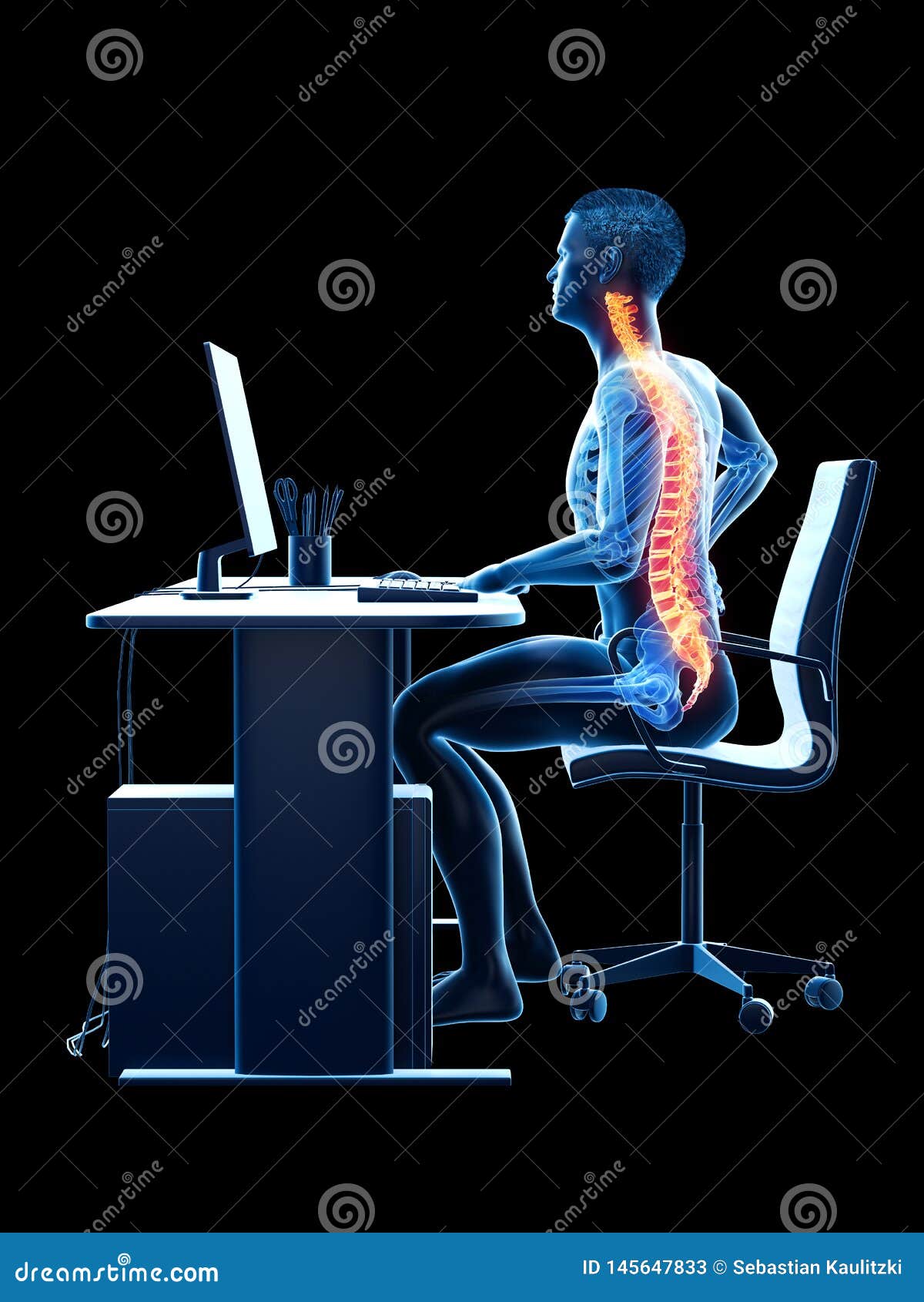 An Office Workers Painful Back Stock Illustration - Illustration of ...