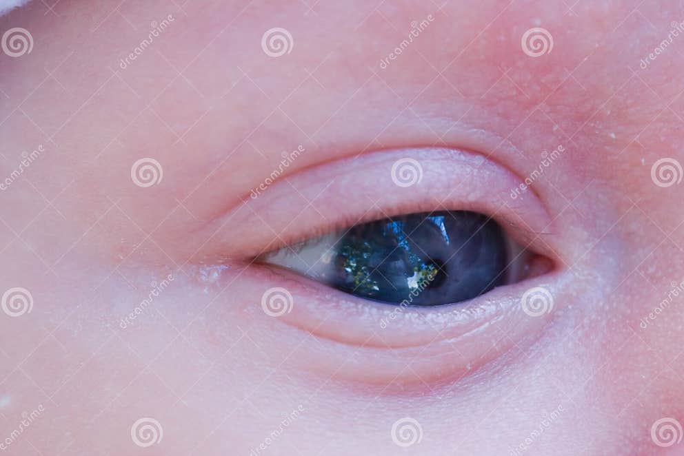 Ojo del bebé foto de archivo. Imagen de idea, observar - 14917114