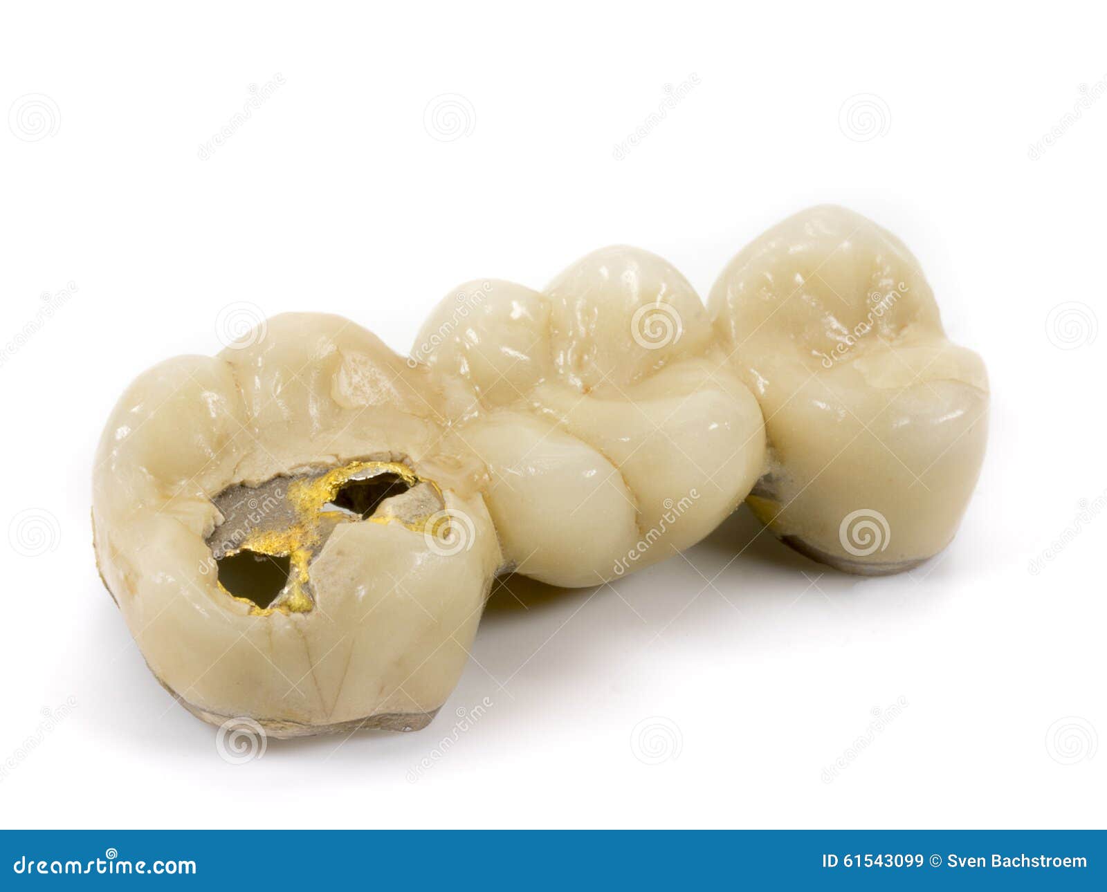Old dental gold stock image. Image of dentistry, decay - 61543099