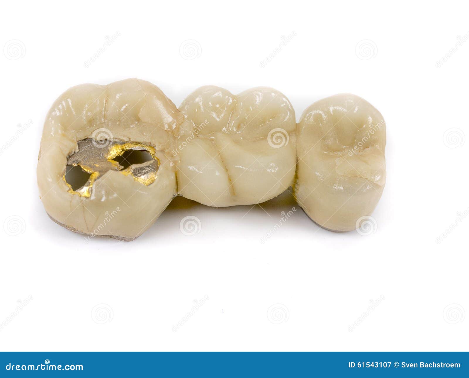 Old dental gold stock image. Image of golden, caries - 61543107