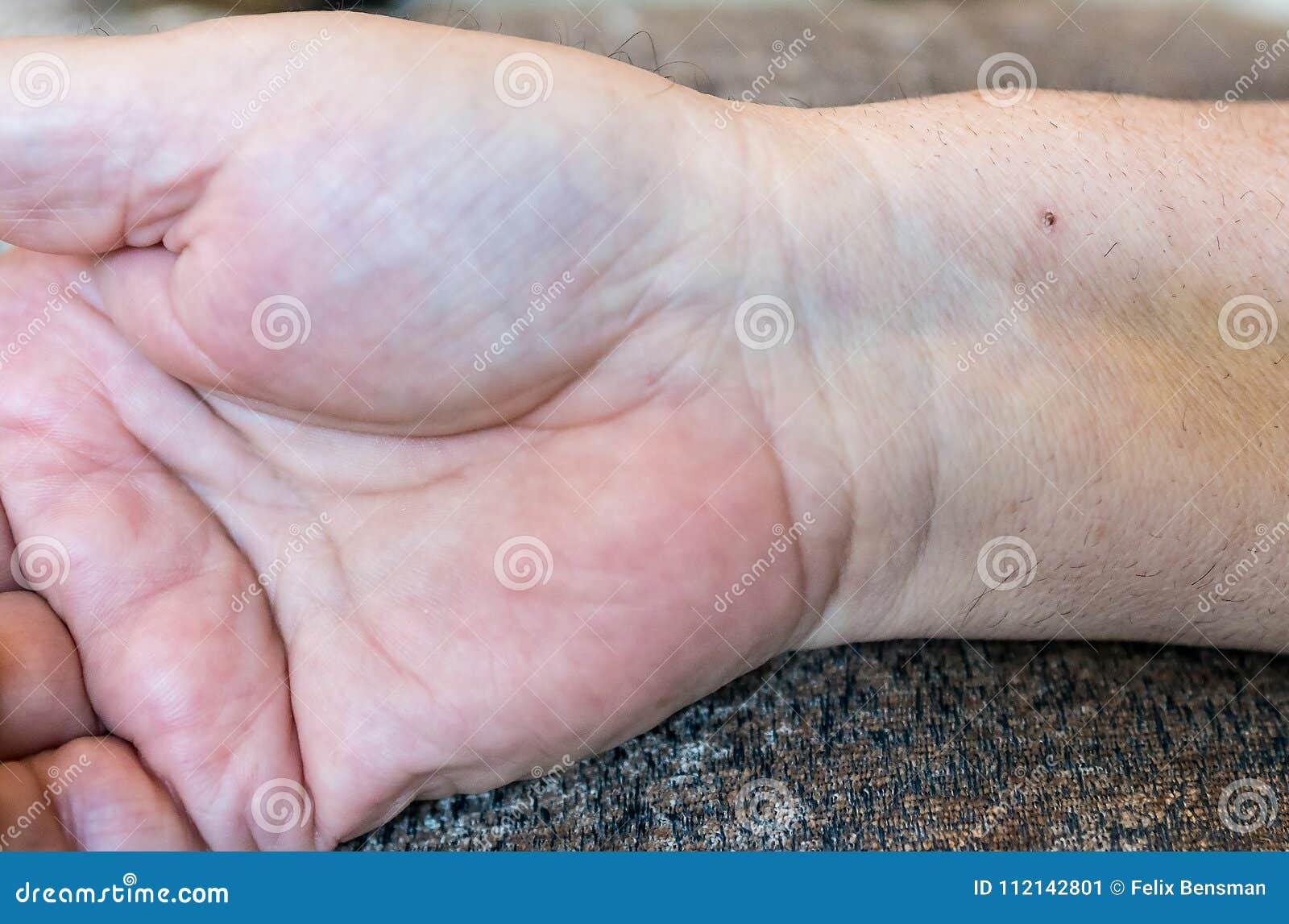 Stent Installation Photos - Free & Royalty-Free Stock Photos from ...