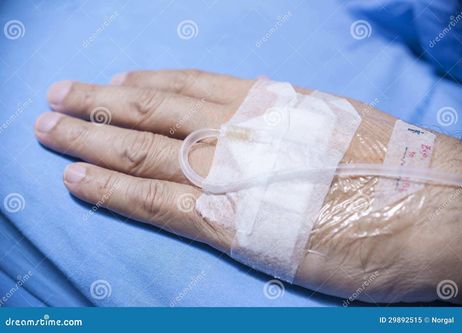 Man hand with IV stock image. Image of patient, service - 29892515