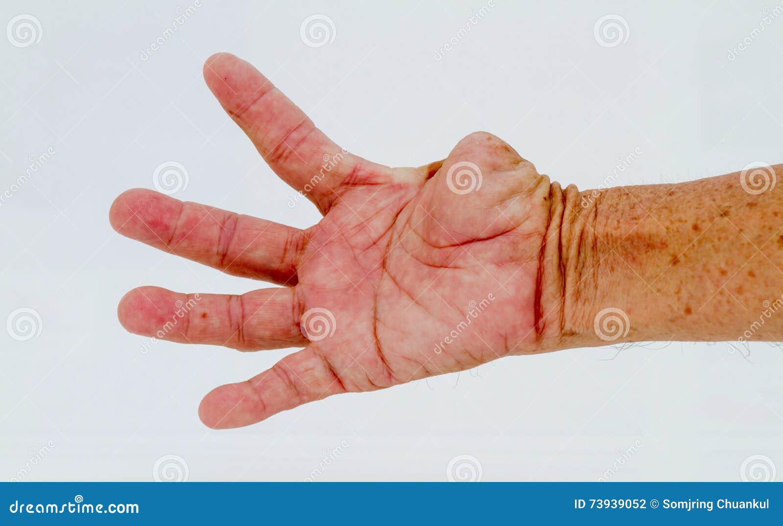 Old Man no the thumb. stock photo. Image of skin, person - 73939052