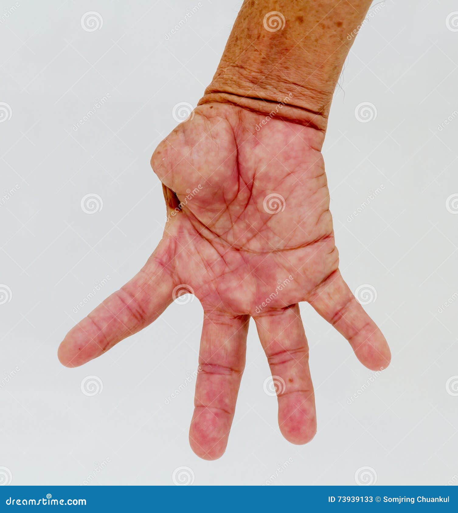Old Man no the thumb. stock image. Image of body, health - 73939133