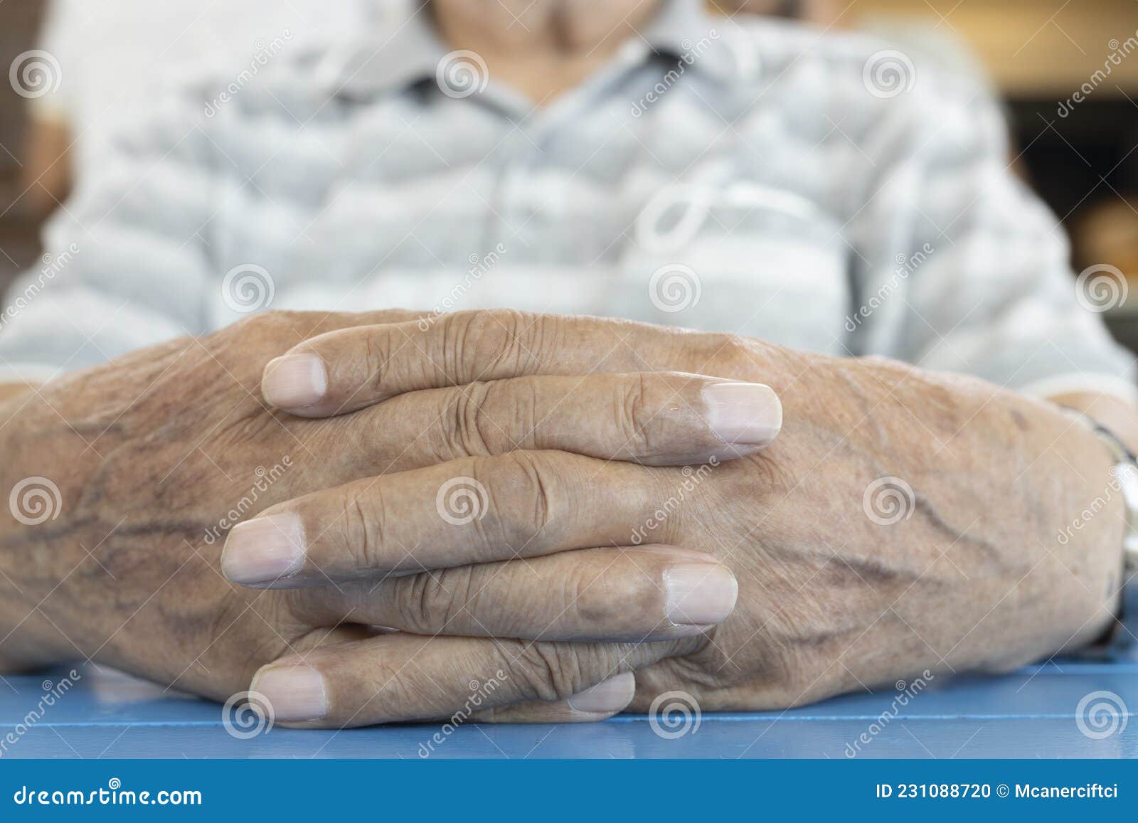 Old Man S Hands. Wrinkled and Deformed. Close-up. Stock Photo - Image ...