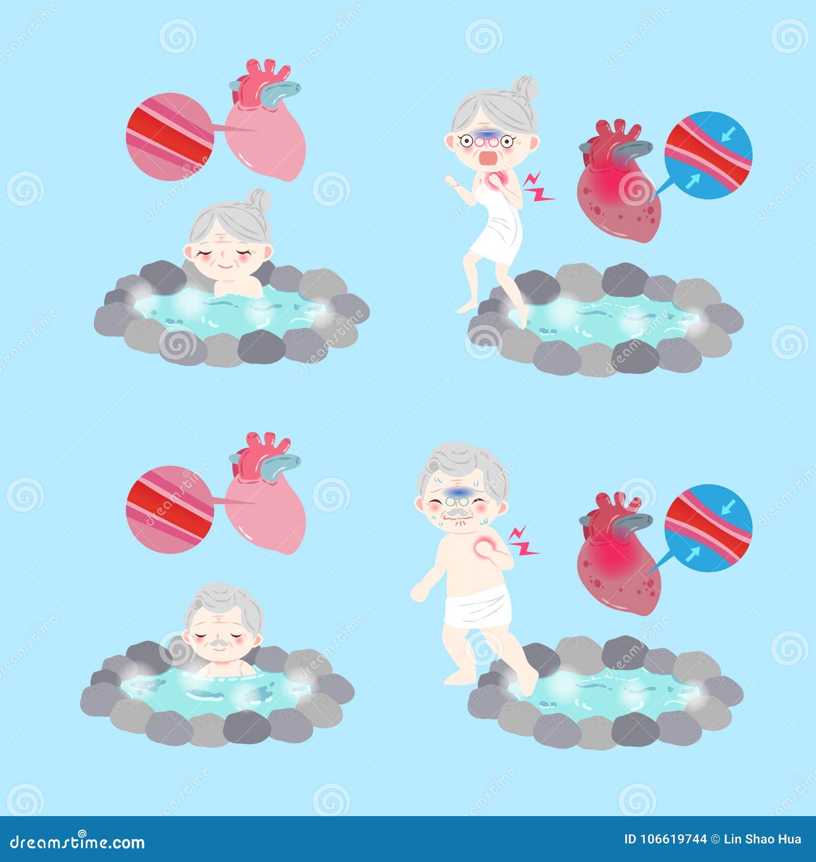 Heart Problem Hypertrophic Cardiomyopathy Cartoon Vector ...